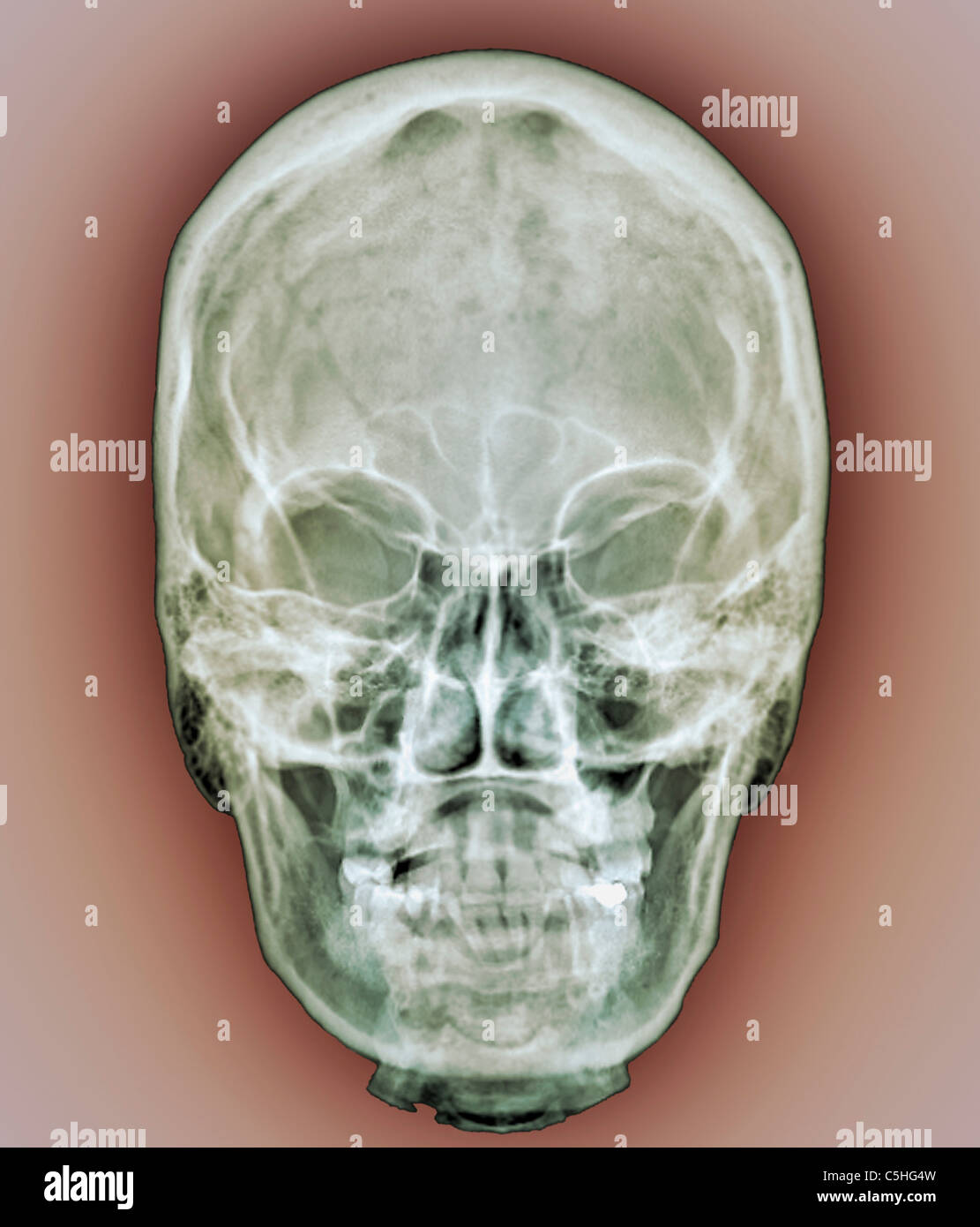 Assistenza sanitaria per il cranio immagini e fotografie stock ad alta ...