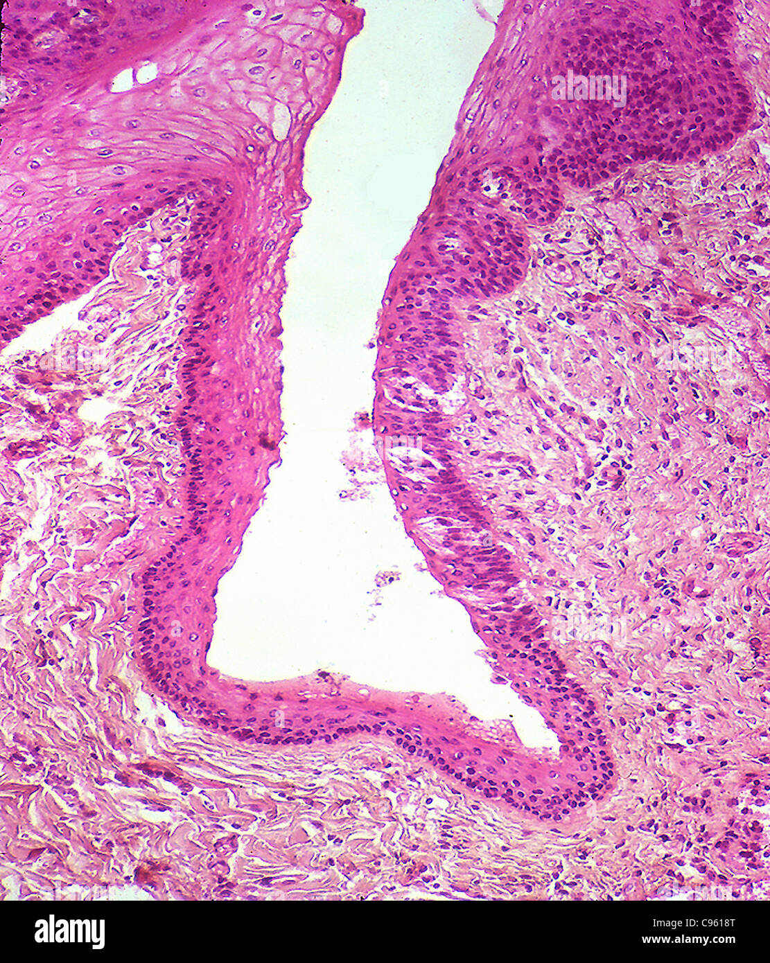 Anatomia delle papille gustative immagini e fotografie stock ad alta ...