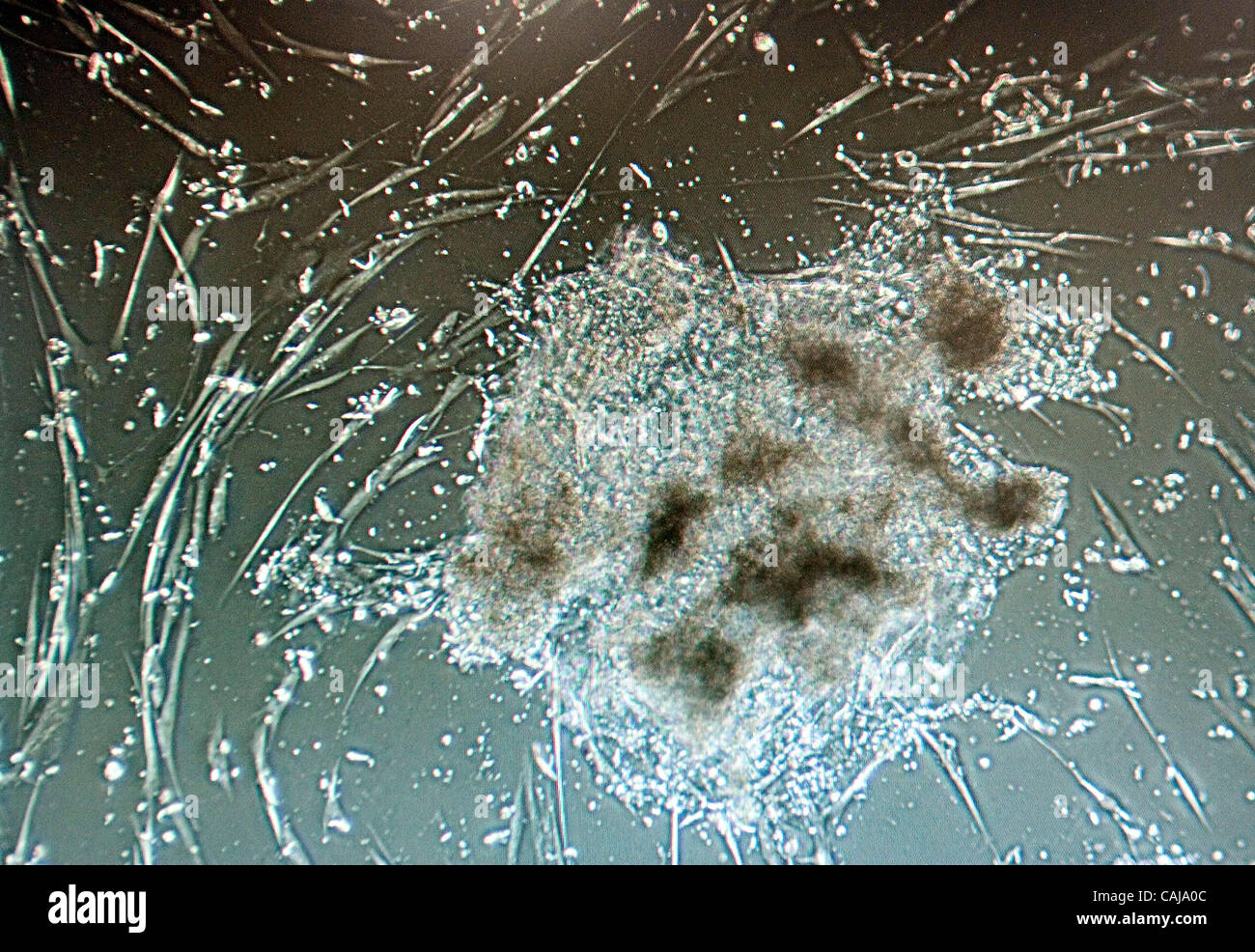 Fibroblasti di tessuto immagini e fotografie stock ad alta risoluzione ...
