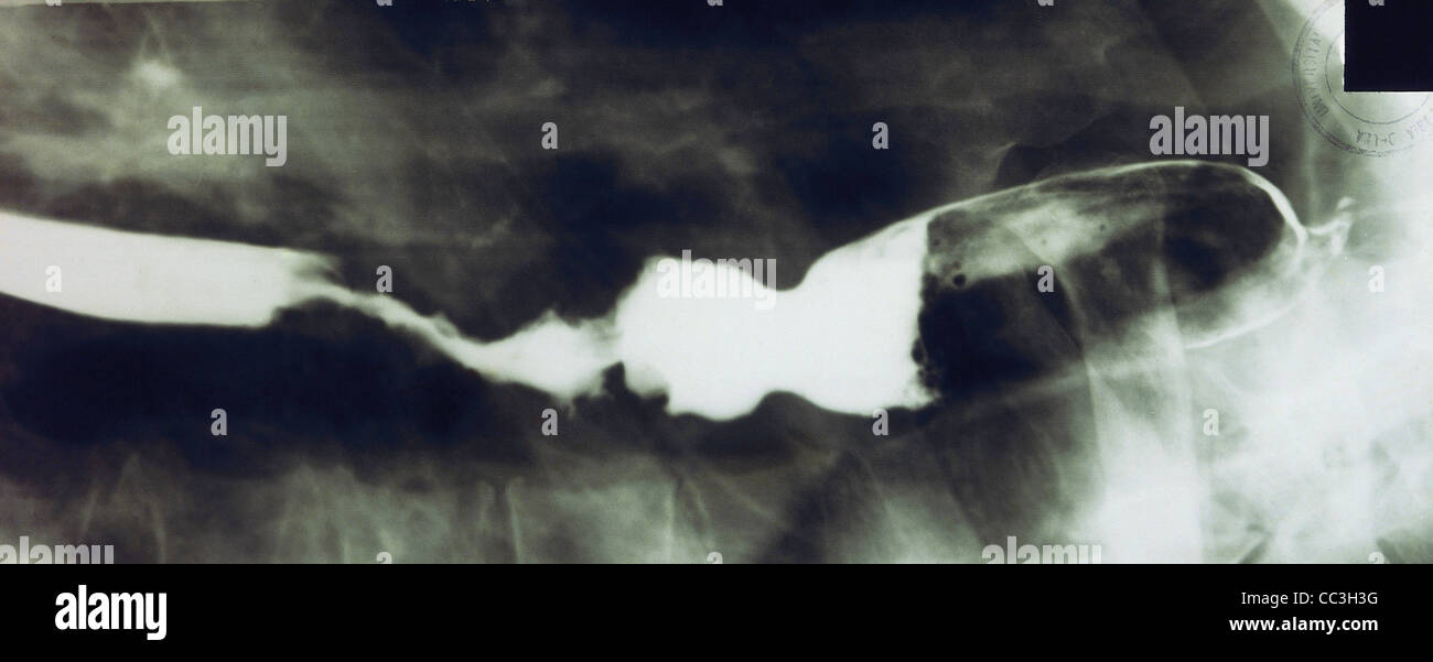 Medicina - Anatomia - Patologia - Diagnostic Imaging - Radiology ...