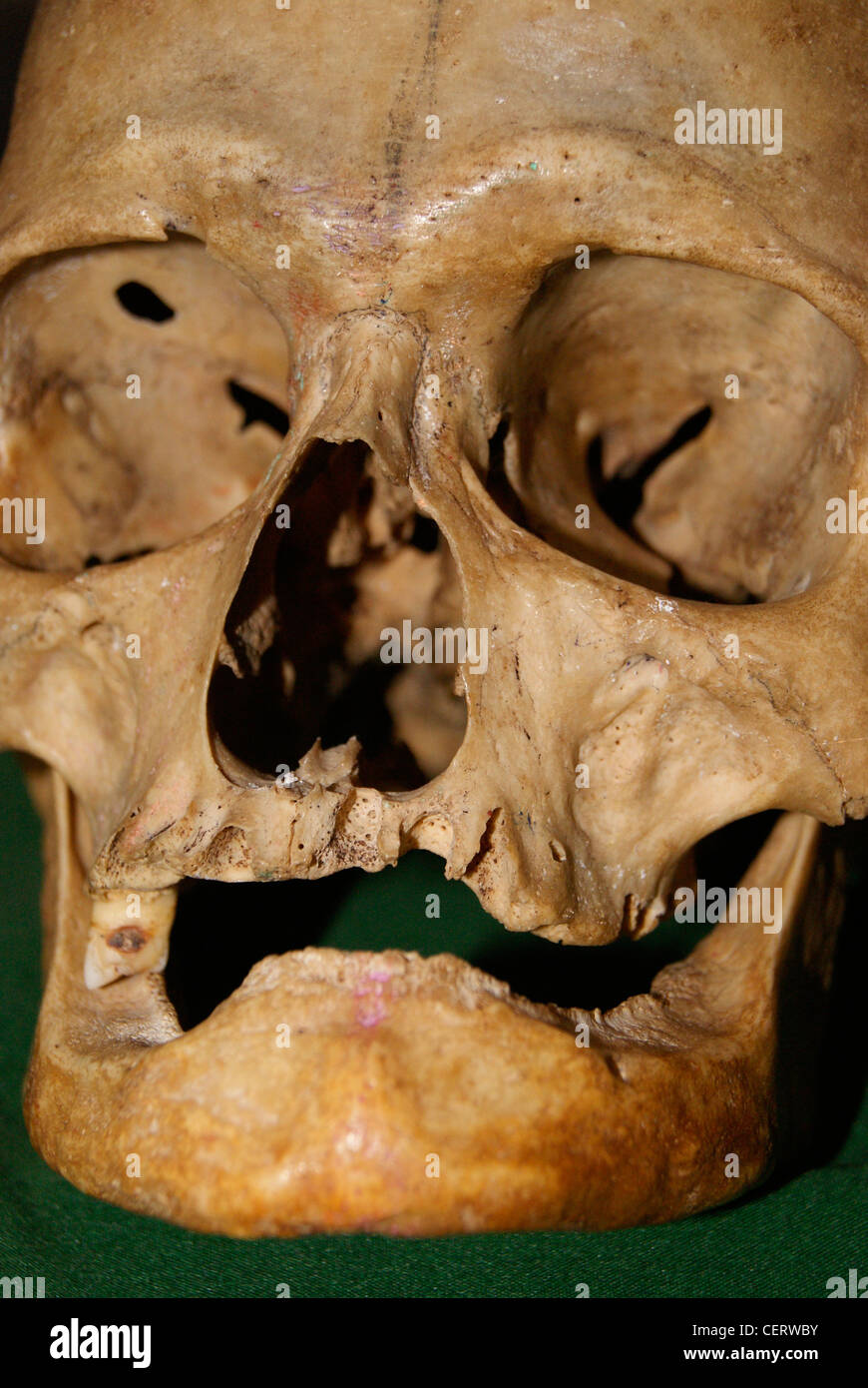 Teschio umano originale immagini e fotografie stock ad alta risoluzione ...