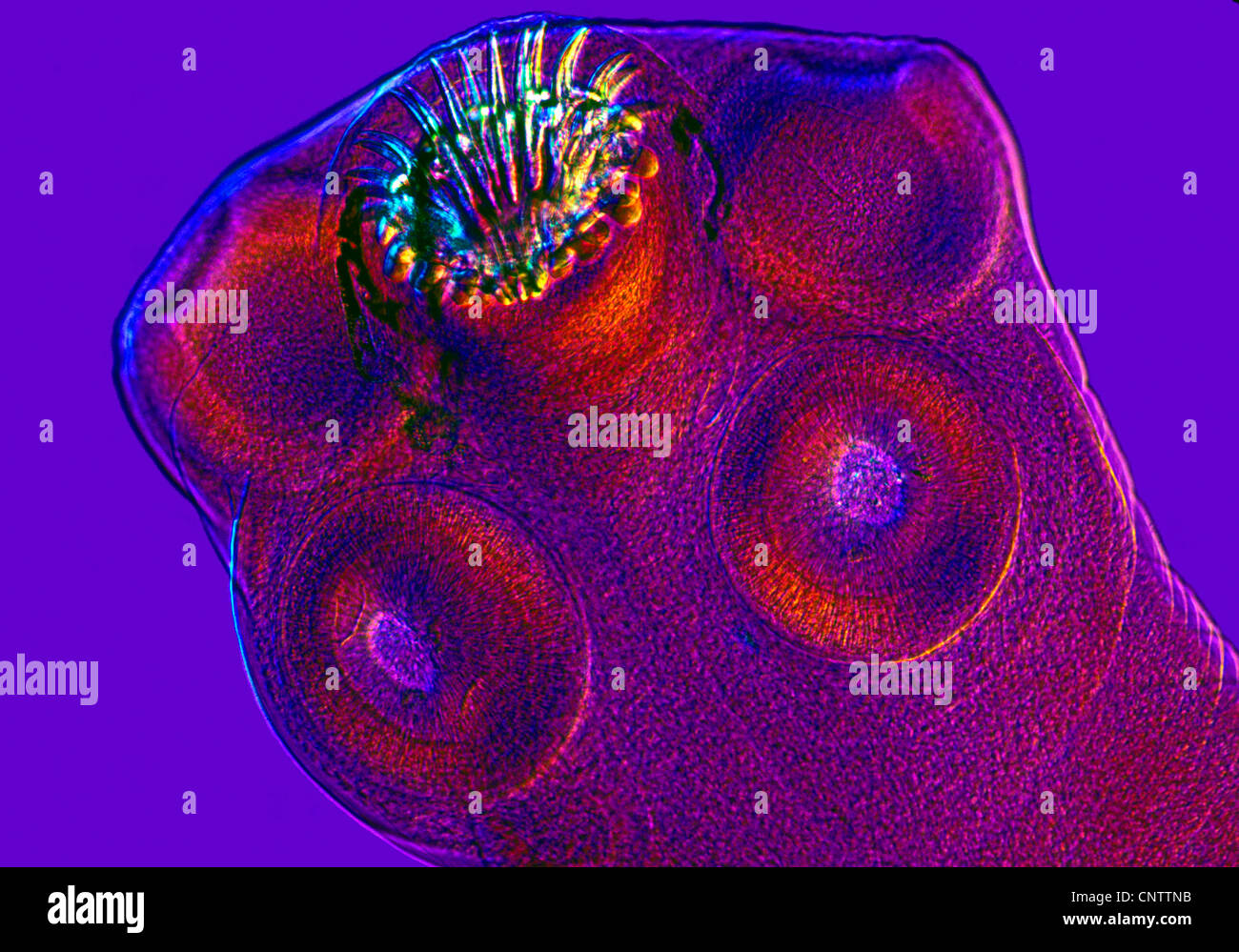 Taenia solium immagini e fotografie stock ad alta risoluzione - Alamy