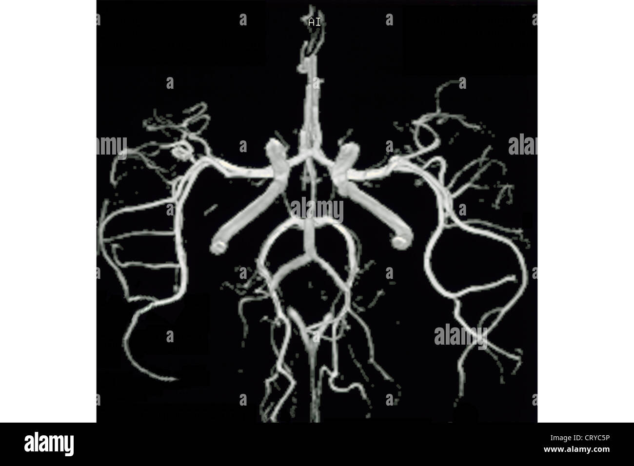 Circolo arterioso di willis immagini e fotografie stock ad alta ...