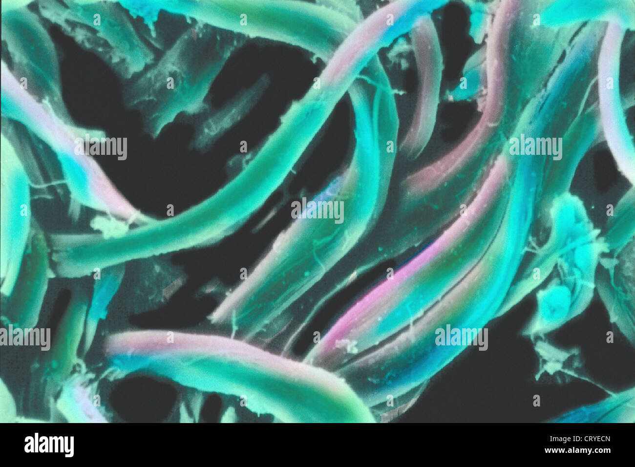 Collagene microscopio elettronico immagini e fotografie stock ad alta risoluzione - Alamy