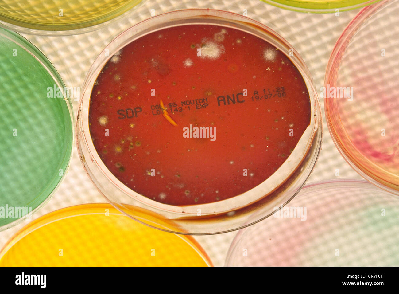 Stafilococco epidermidis immagini e fotografie stock ad alta ...