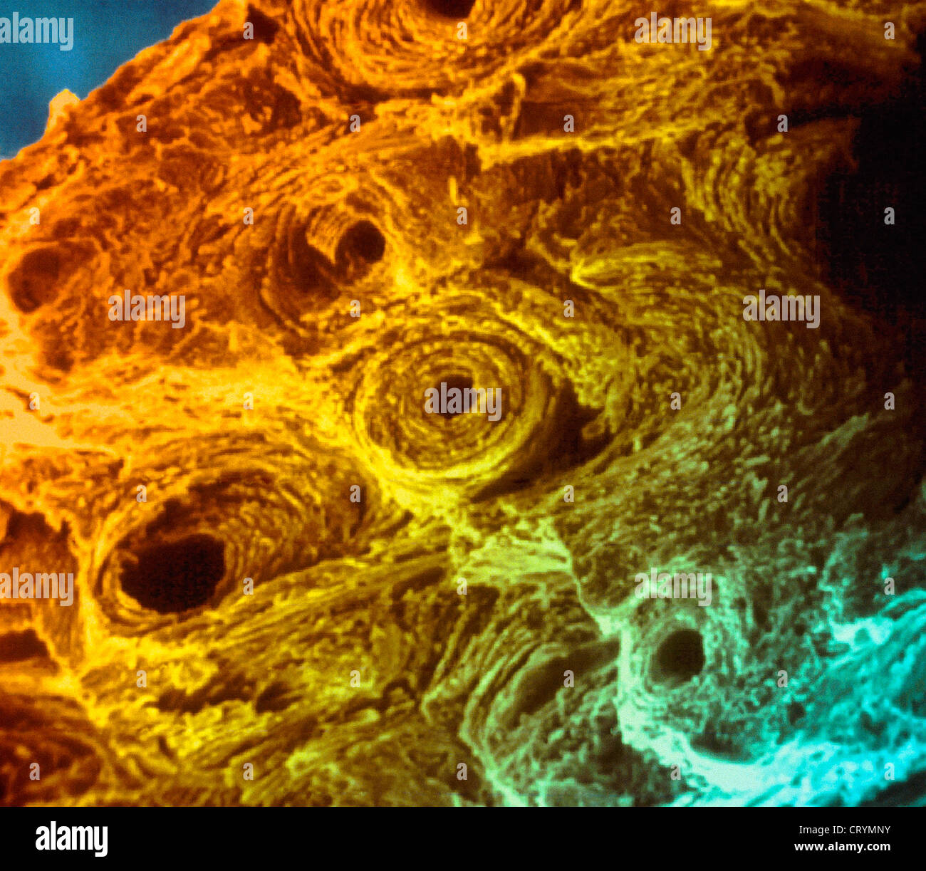 Osso compatto immagini e fotografie stock ad alta risoluzione - Alamy