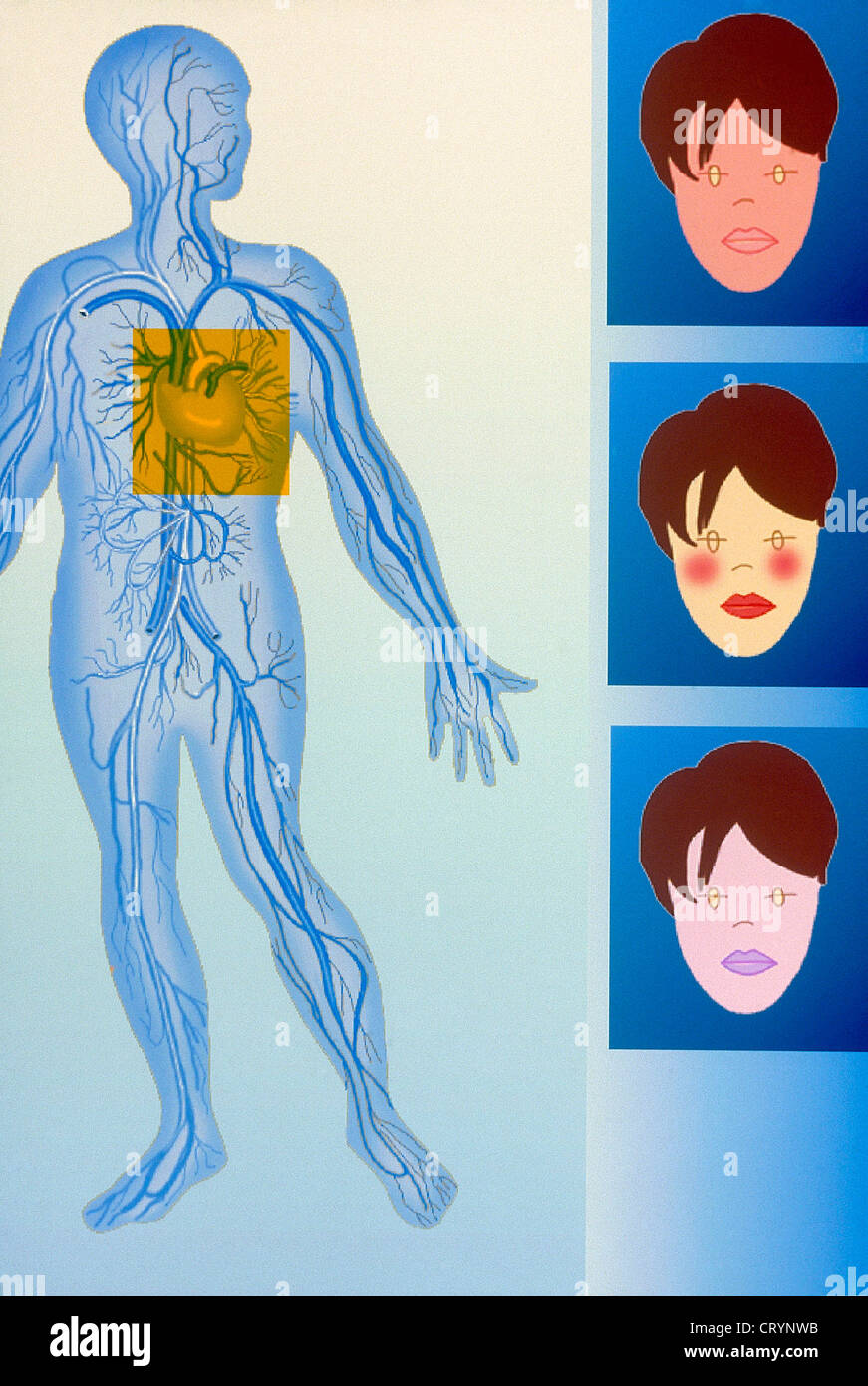 Morbo di addison immagini e fotografie stock ad alta risoluzione - Alamy