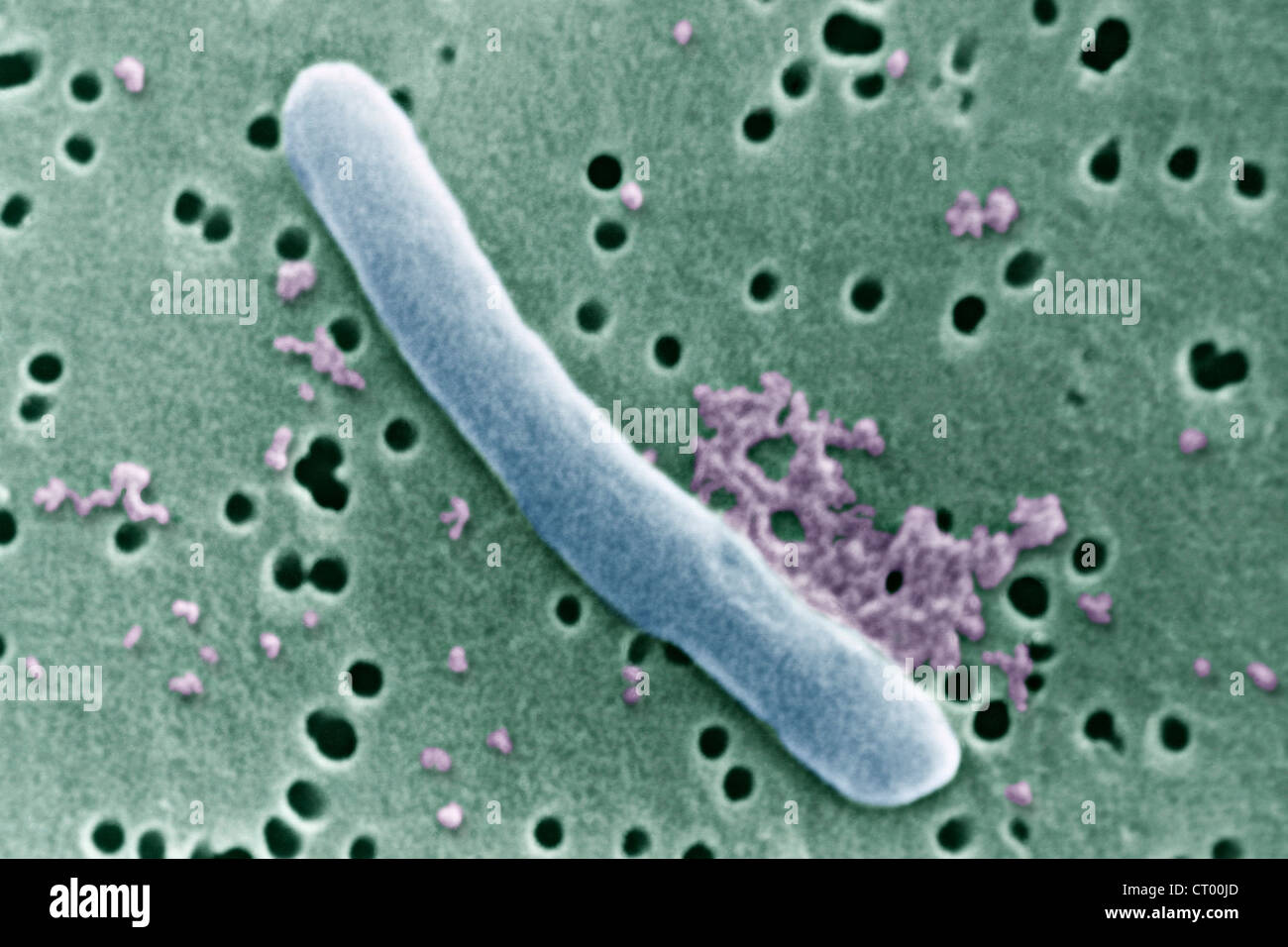 Clostridium tetani immagini e fotografie stock ad alta risoluzione - Alamy