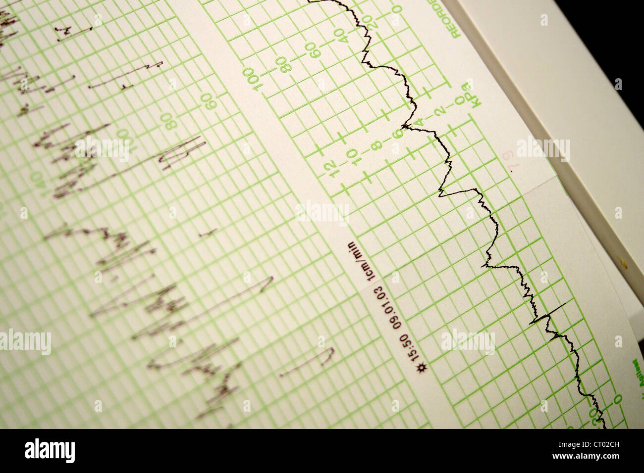 Cardiotocografia esame cardiotocografia immagini e fotografie stock ad ...
