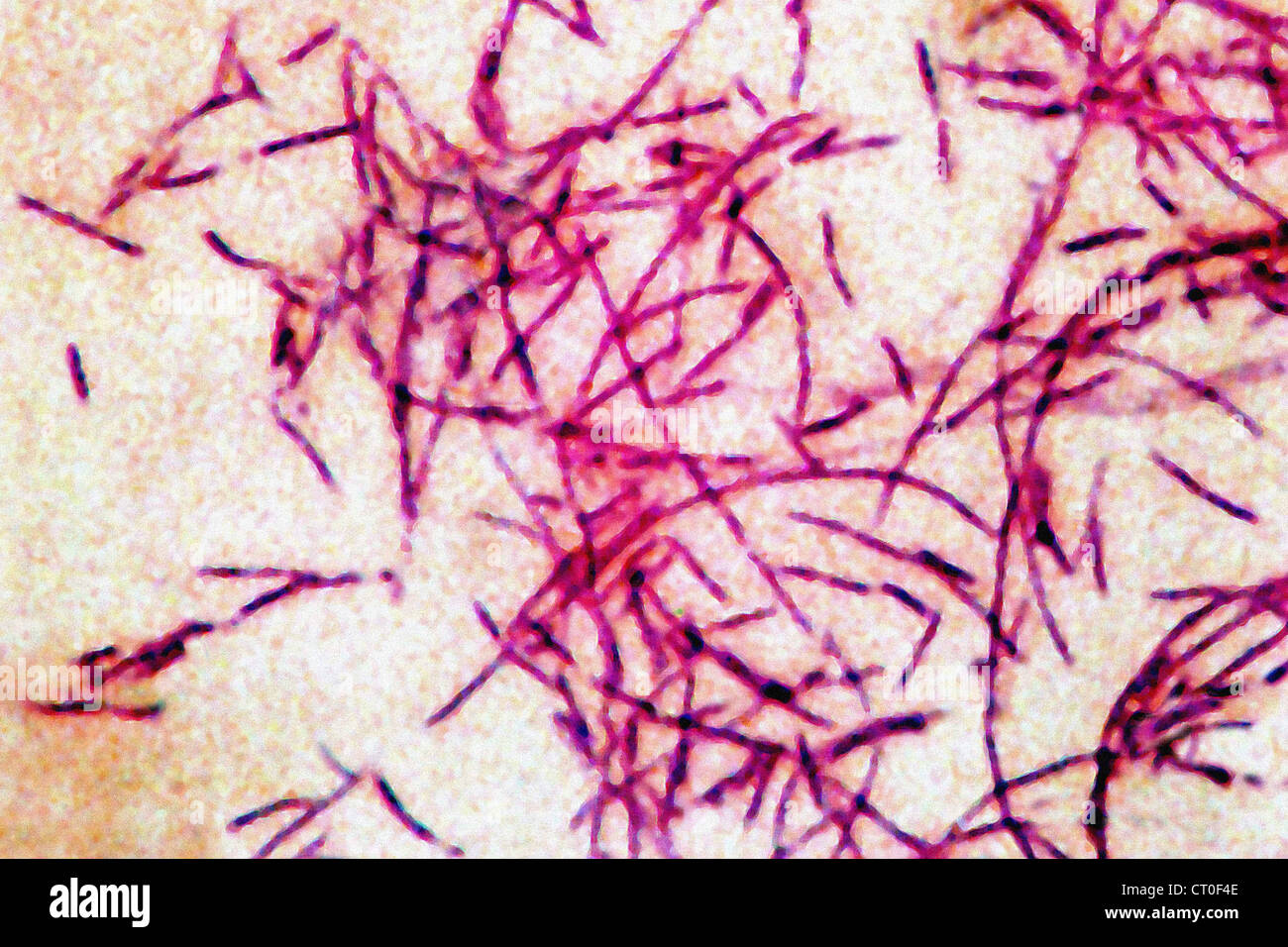 Test della legionella immagini e fotografie stock ad alta risoluzione ...