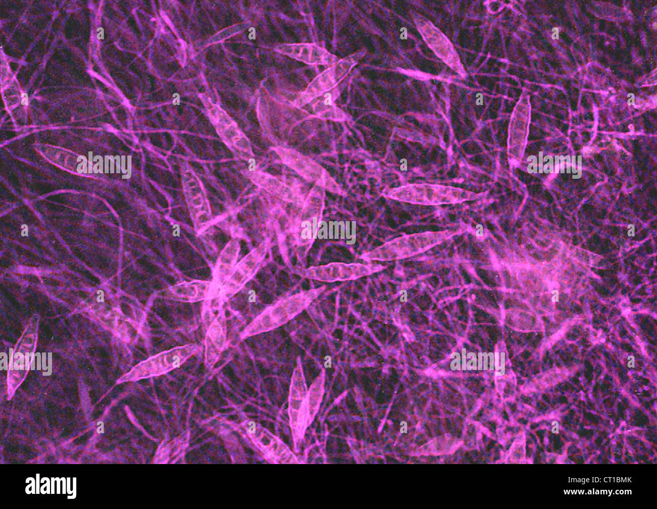 Microsporum canis immagini e fotografie stock ad alta risoluzione - Alamy