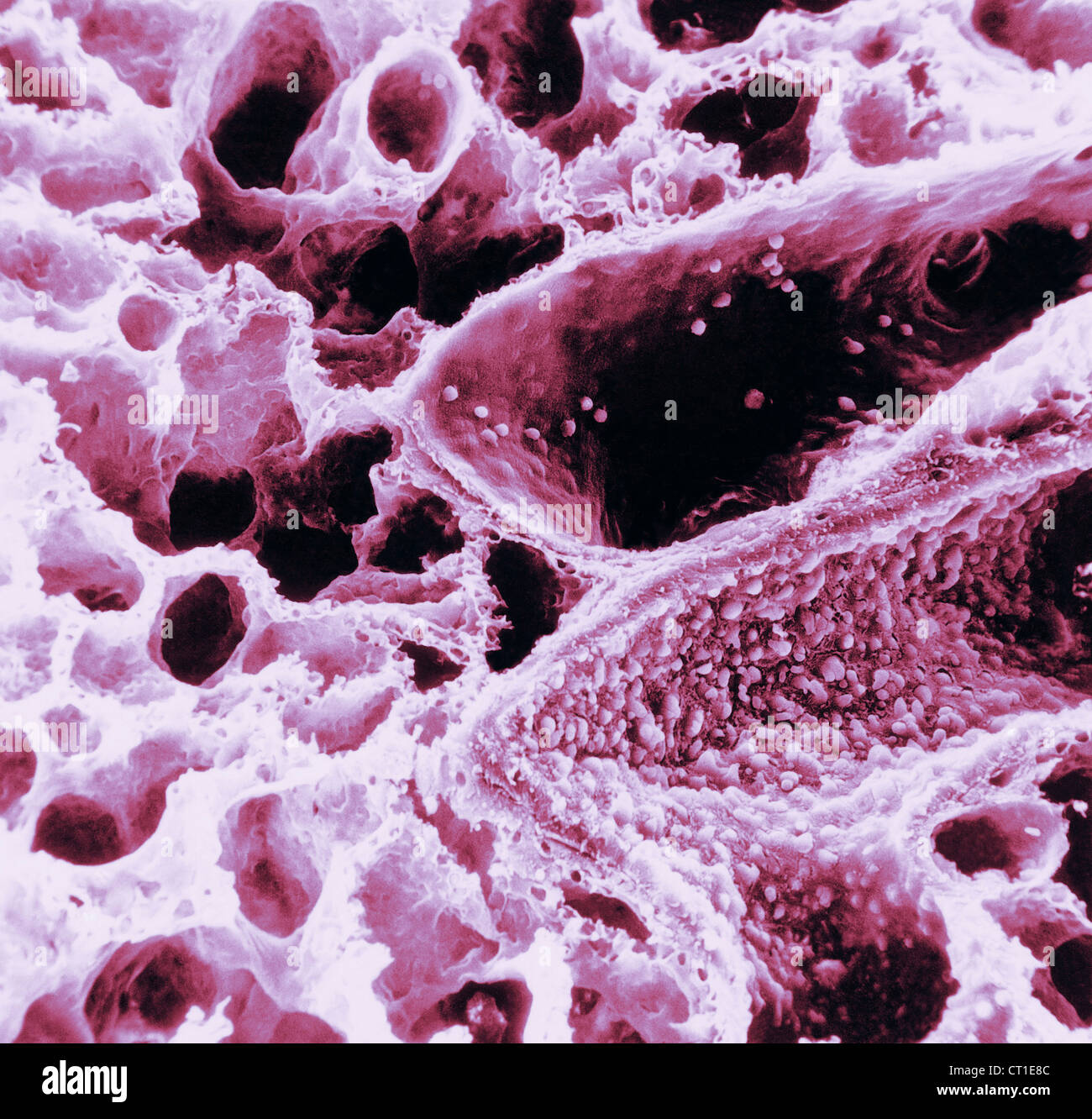 Alveoli polmonari, SEM Foto stock - Alamy