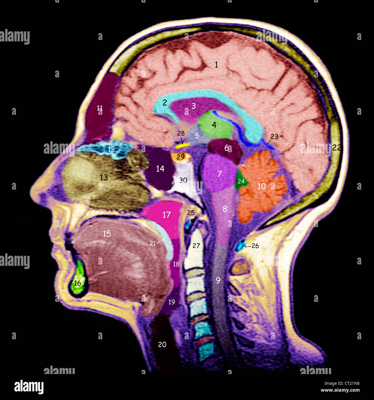 Vene cerebrali interne immagini e fotografie stock ad alta risoluzione ...