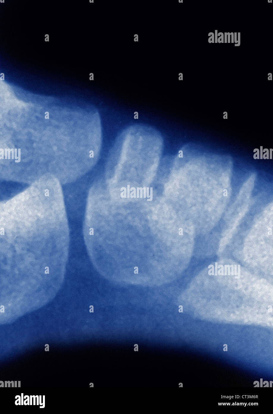 Ossa tarsali immagini e fotografie stock ad alta risoluzione - Alamy