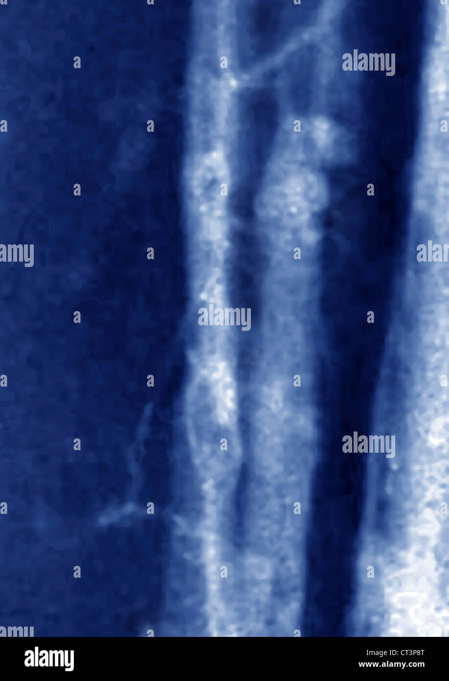 Vene fibulari immagini e fotografie stock ad alta risoluzione - Alamy