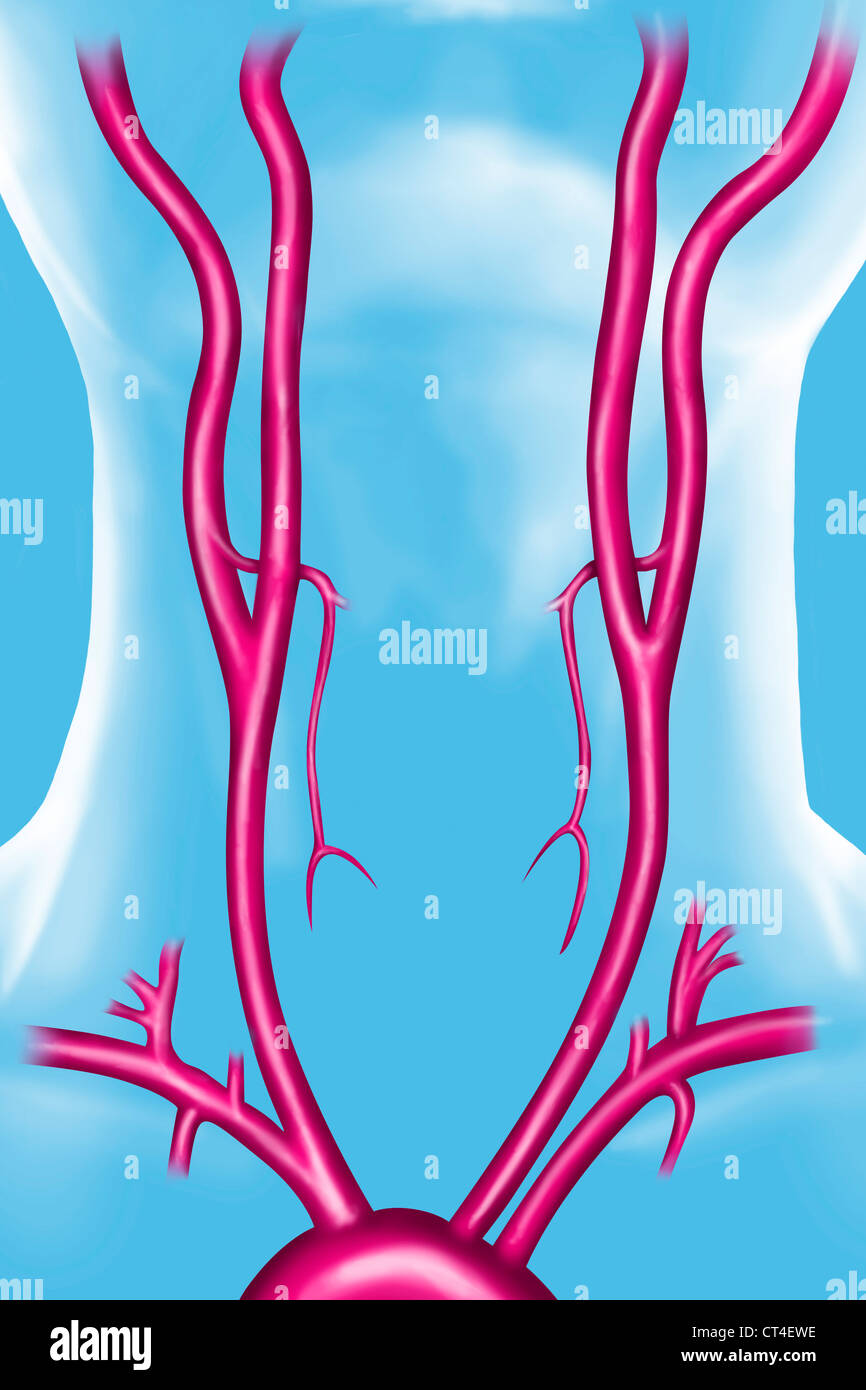 Arteria carotide esterna immagini e fotografie stock ad alta ...