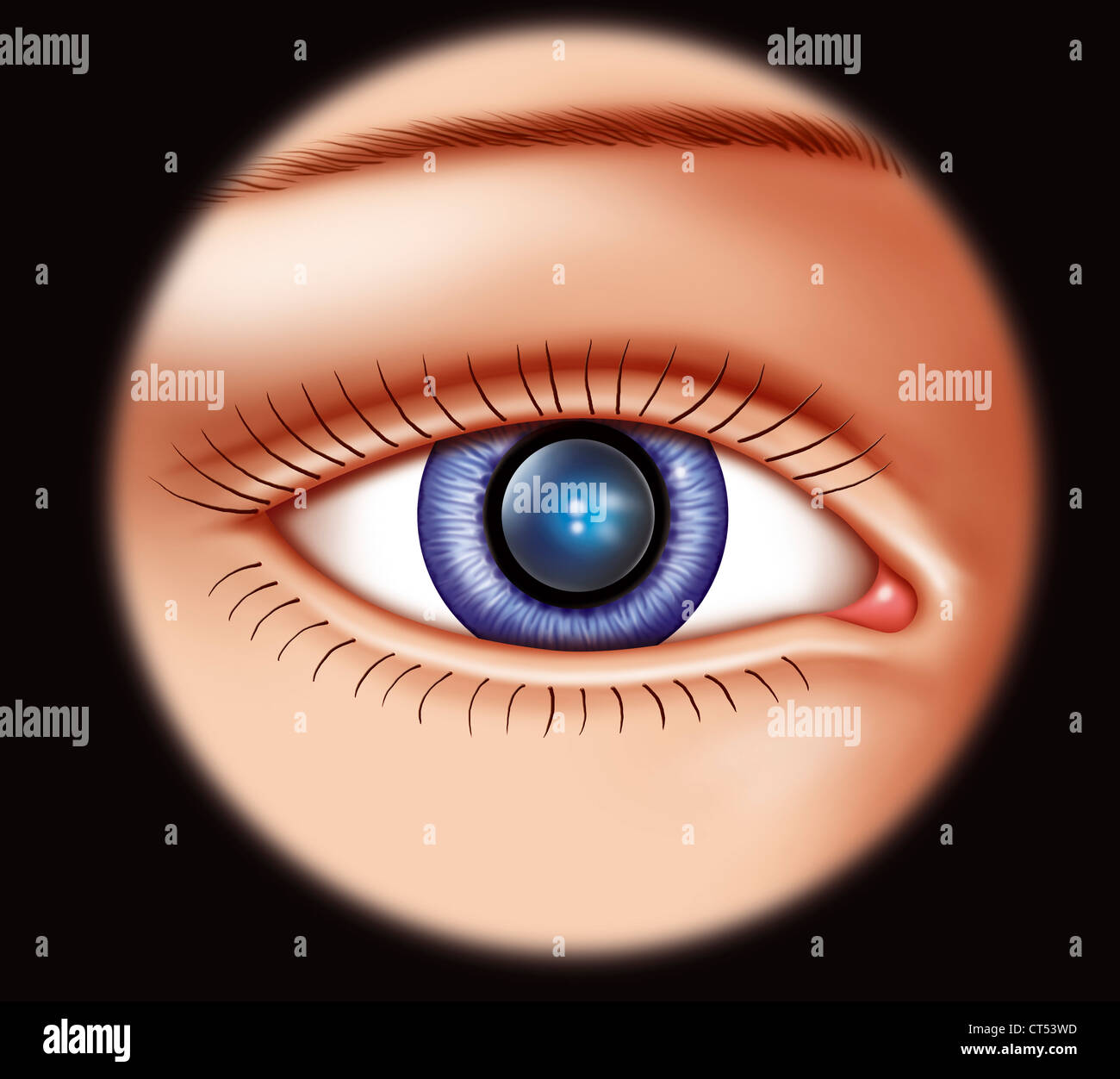Lente intraoculare immagini e fotografie stock ad alta risoluzione - Alamy