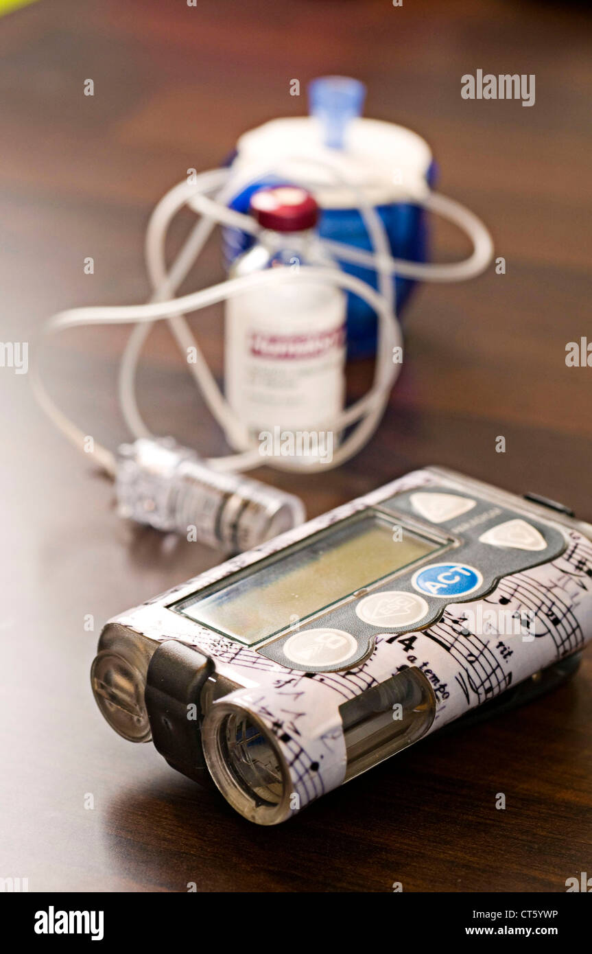 Pompa Per Infusione Ambulatoriale Esterna Di Insulina