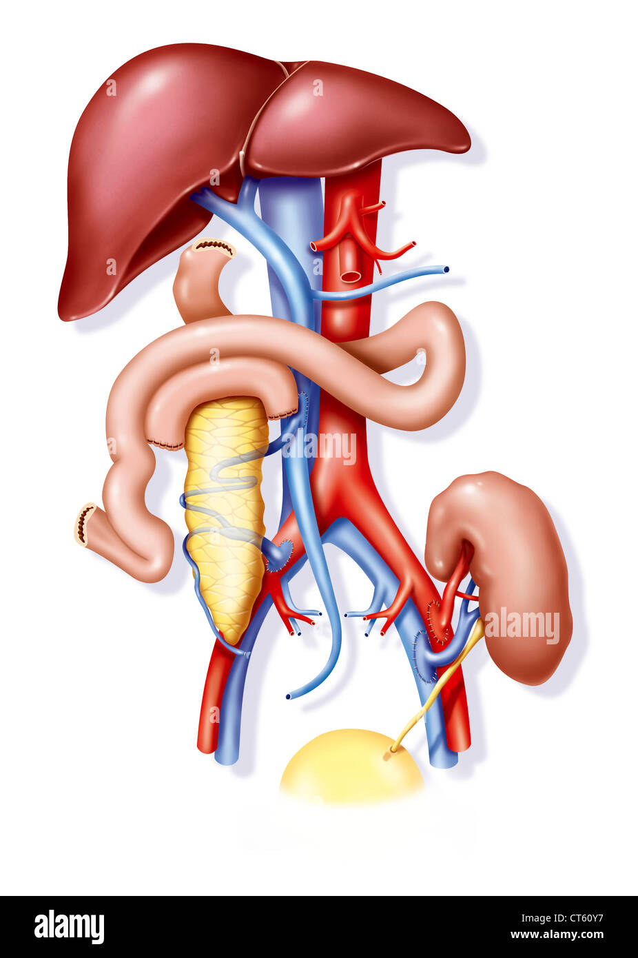 Trapianto di intestino tenue immagini e fotografie stock ad alta ...