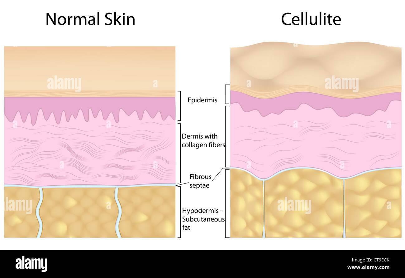 Connective tissue with collagen fibers immagini e fotografie stock ad ...