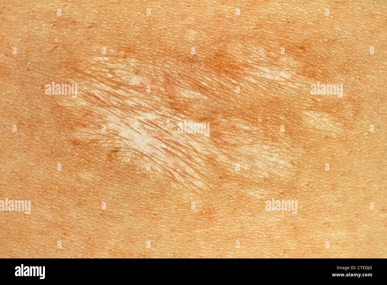 Morso di cane immagini e fotografie stock ad alta risoluzione - Alamy