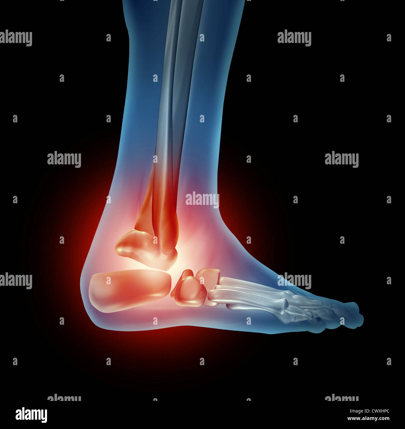 Caviglia piede dolore con uno scheletro del corpo a piedi parte con le ...