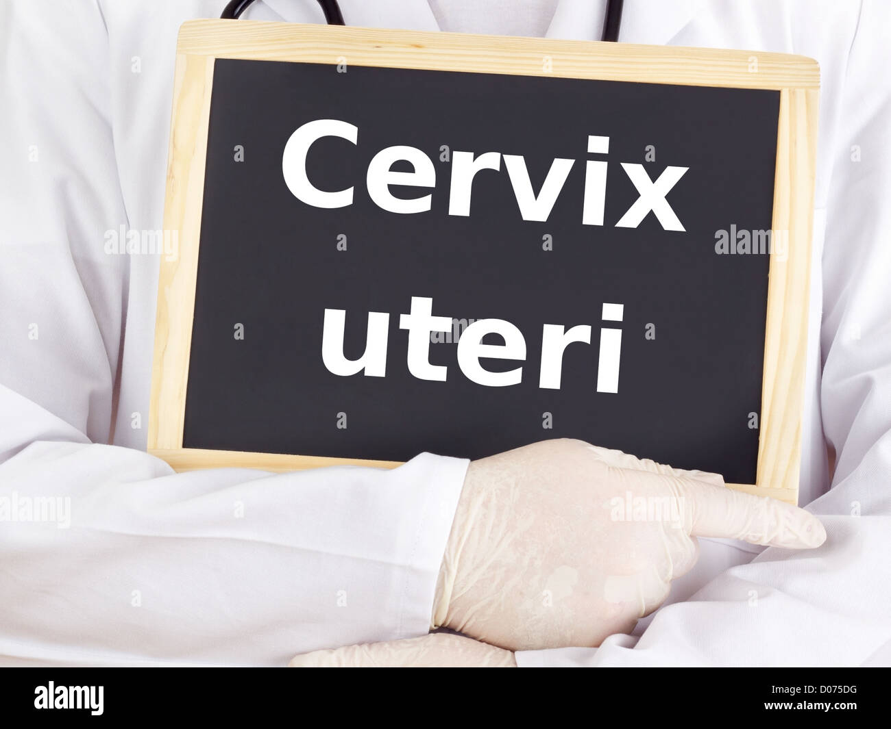 Cervice uterina immagini e fotografie stock ad alta risoluzione - Alamy
