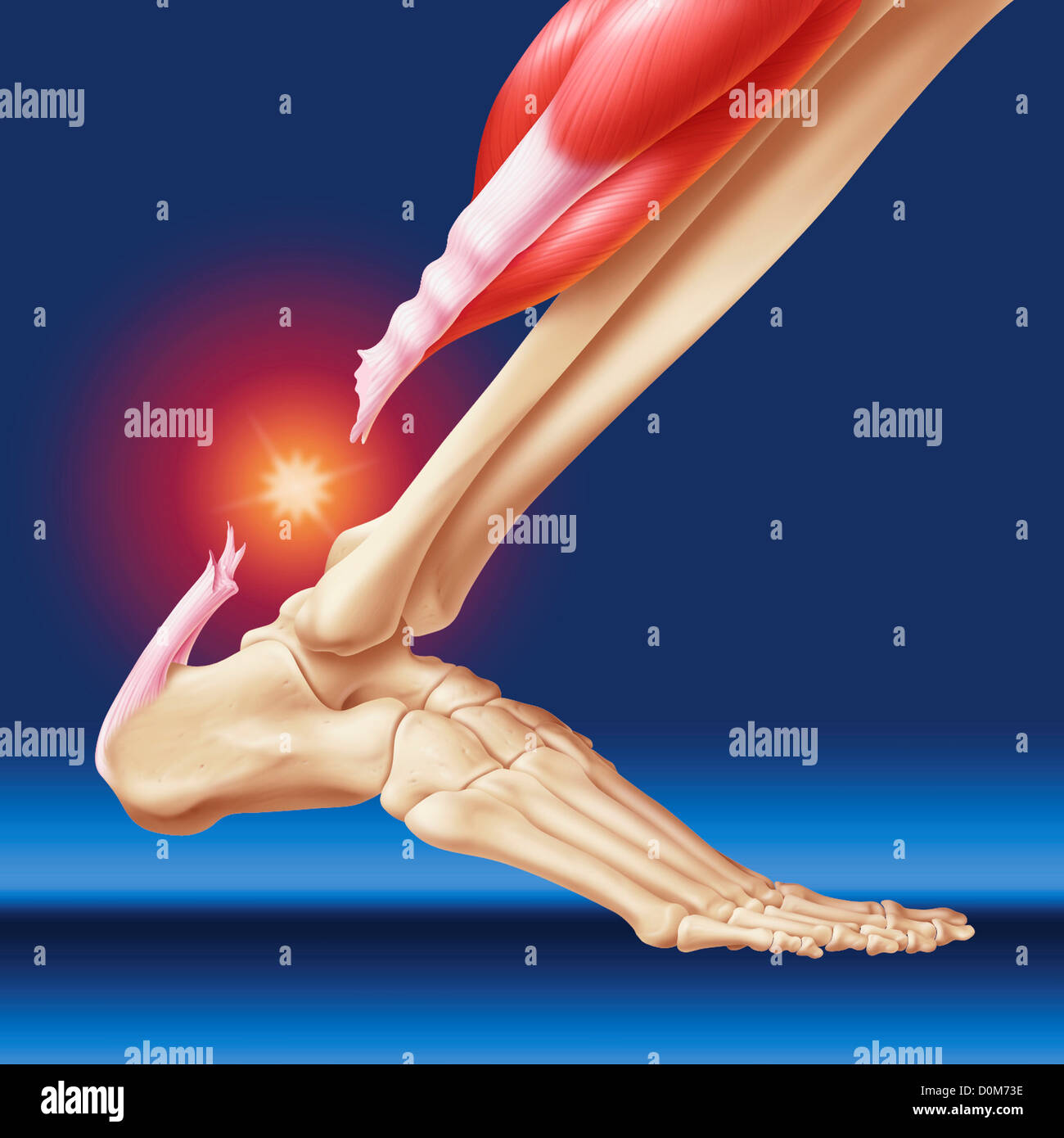 Tendine Di Achille Calcaneale Immagini e Fotos Stock - Alamy