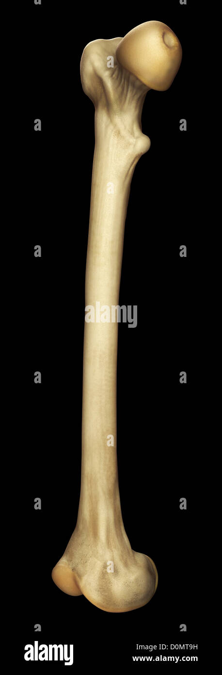 Collo del femore immagini e fotografie stock ad alta risoluzione ...