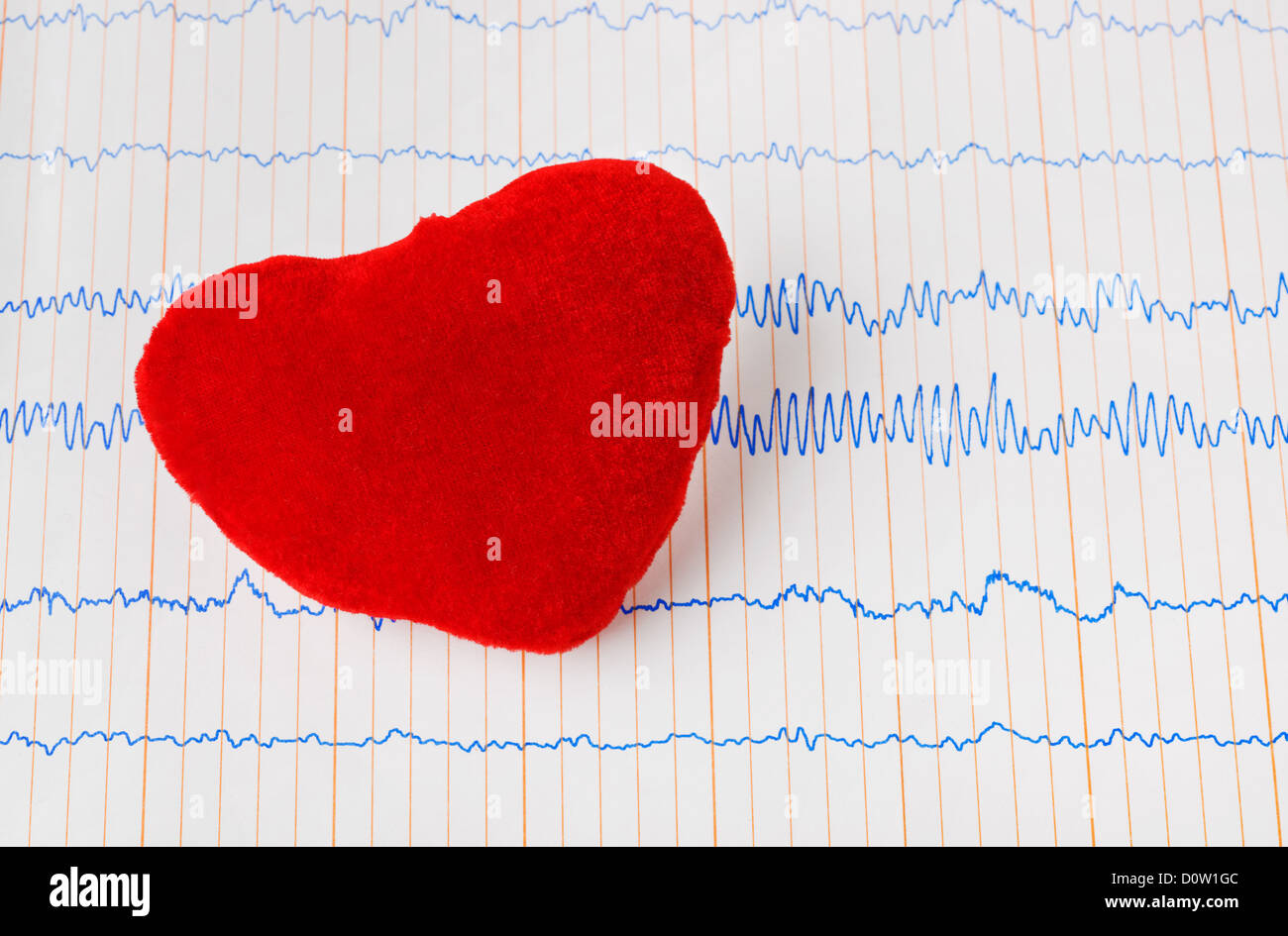 Traccia di cuore ecg immagini e fotografie stock ad alta risoluzione ...