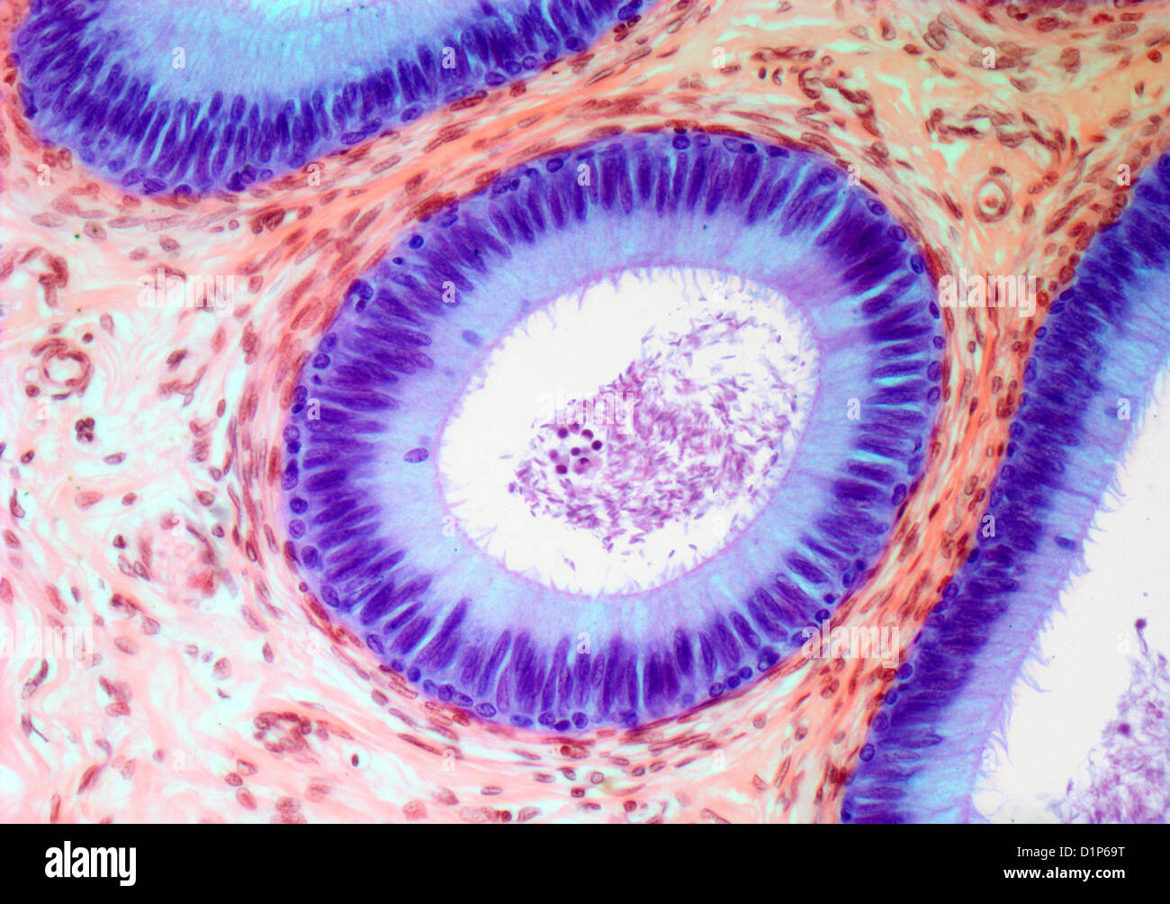 Epididimo anatomía immagini e fotografie stock ad alta risoluzione - Alamy