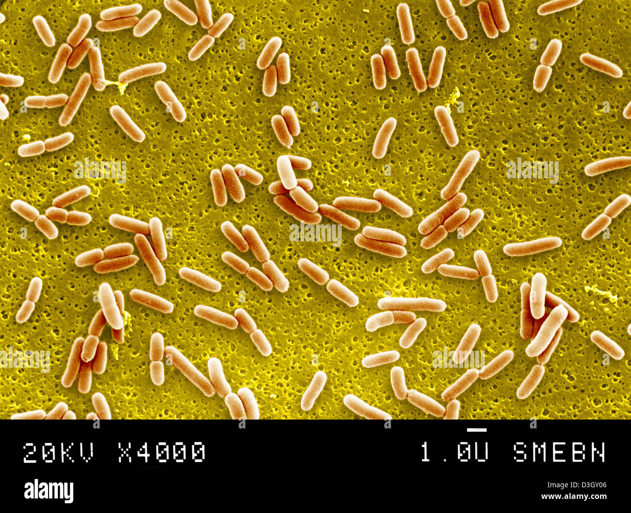 Batterio escherichia coli sem immagini e fotografie stock ad alta ...