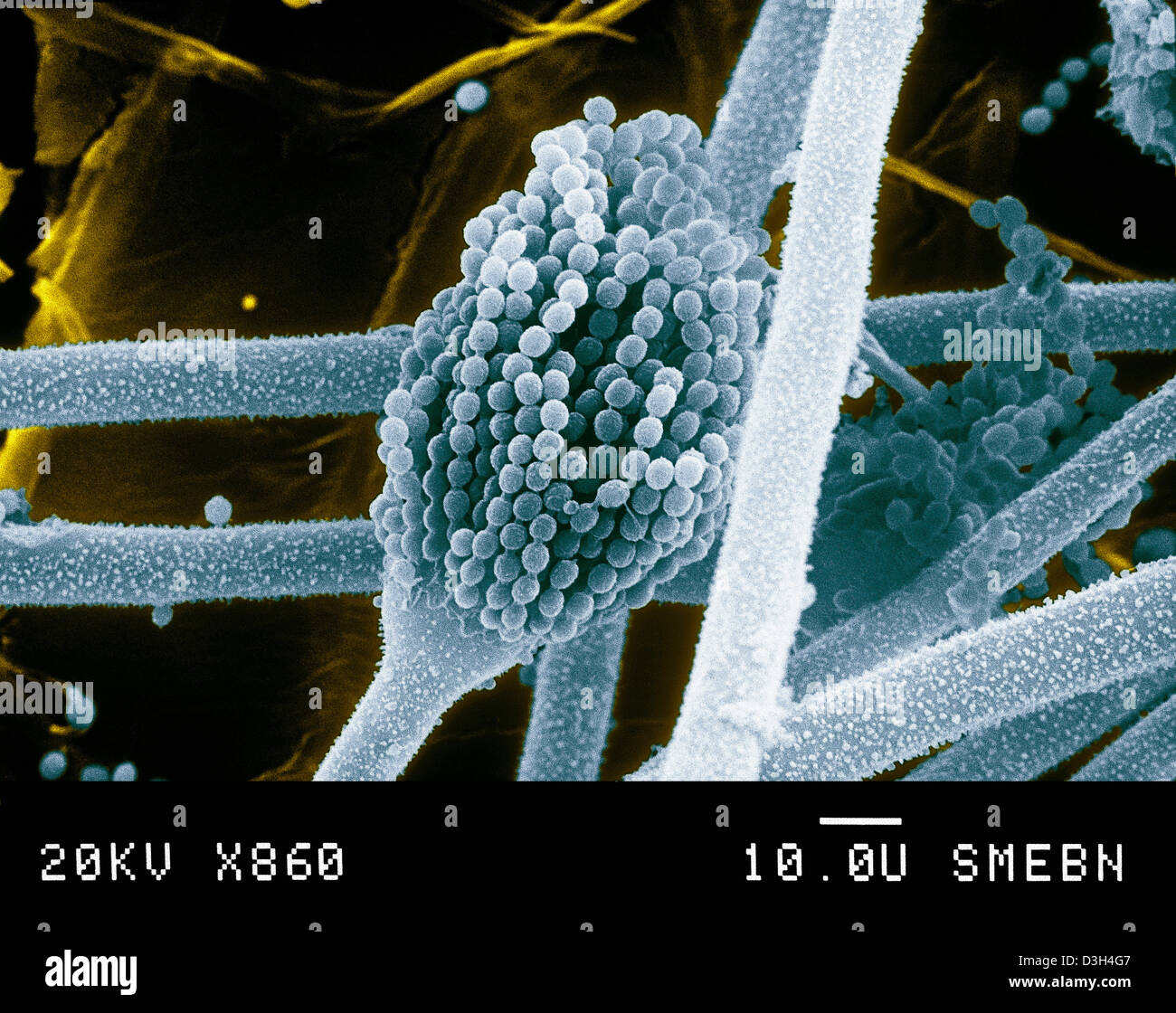 Aspergillus flavus immagini e fotografie stock ad alta risoluzione - Alamy