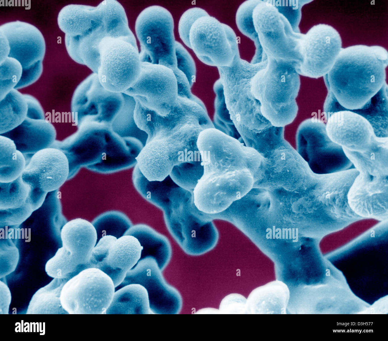 Alveoli polmonari, SEM Foto stock - Alamy