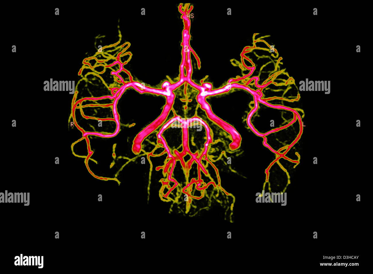 Circolo arterioso di willis immagini e fotografie stock ad alta ...