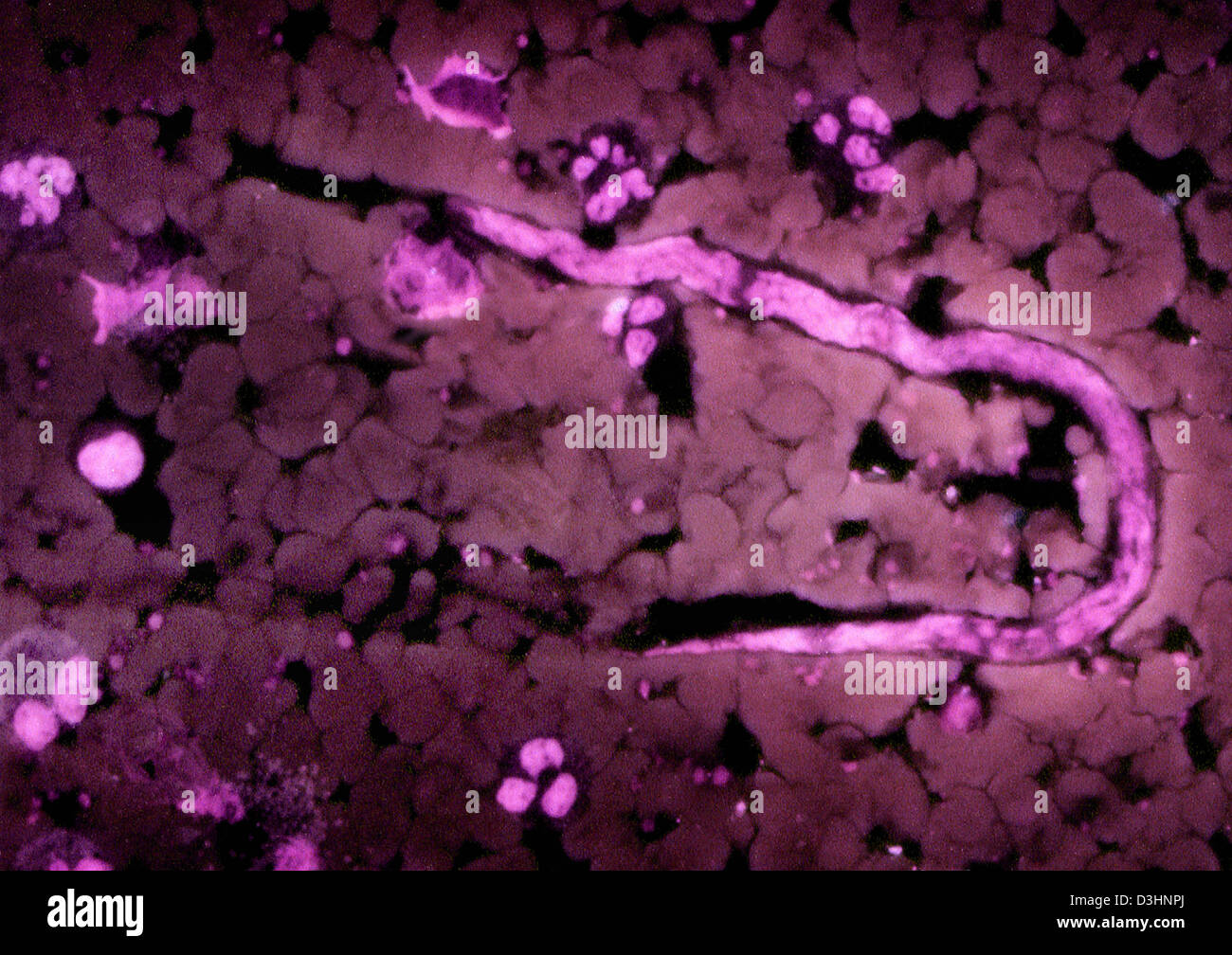 Onchocerca volvulus worm parassita immagini e fotografie stock ad alta ...