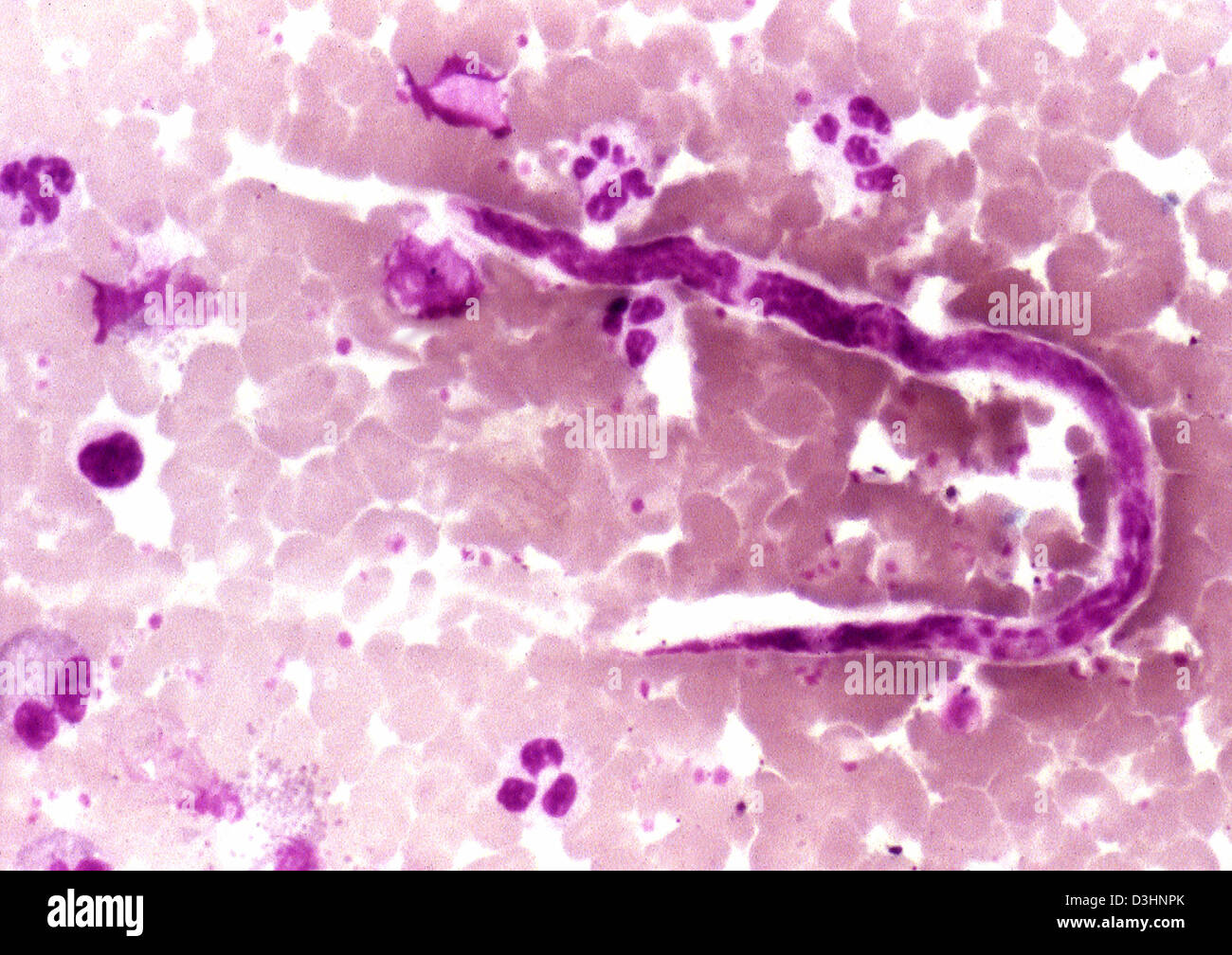Onchocerca volvulus worm parassita immagini e fotografie stock ad alta ...