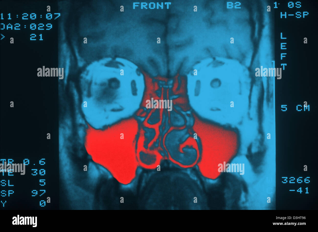 Risonanza magnetica imaging mri immagini e fotografie stock ad alta ...