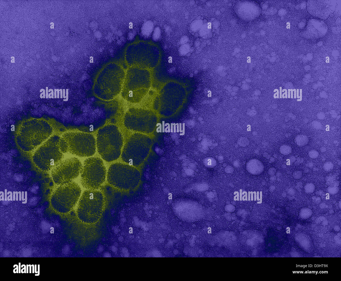 Virus del vaiolo immagini e fotografie stock ad alta risoluzione - Alamy