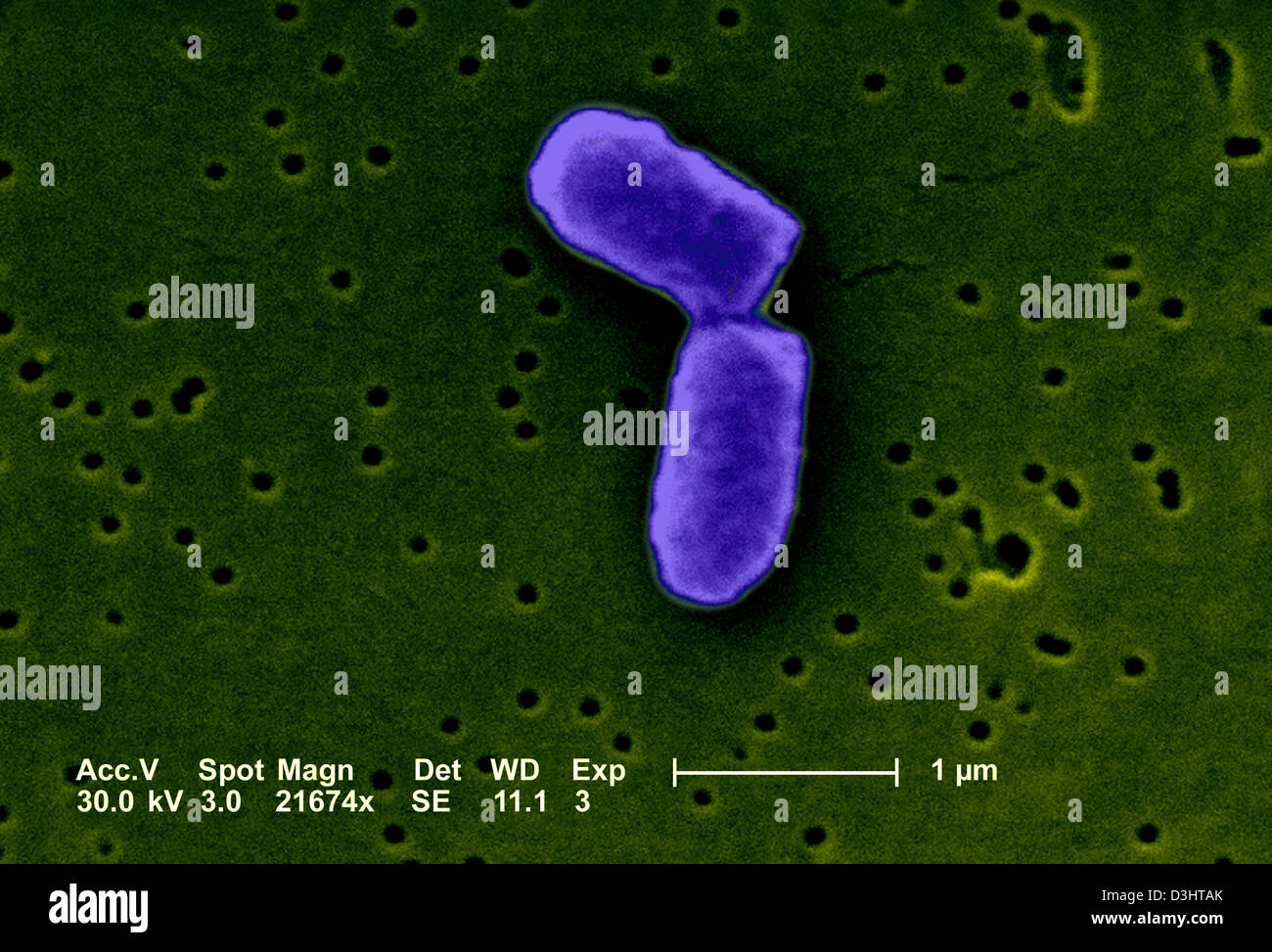 Escherichia coli bacterium immagini e fotografie stock ad alta ...