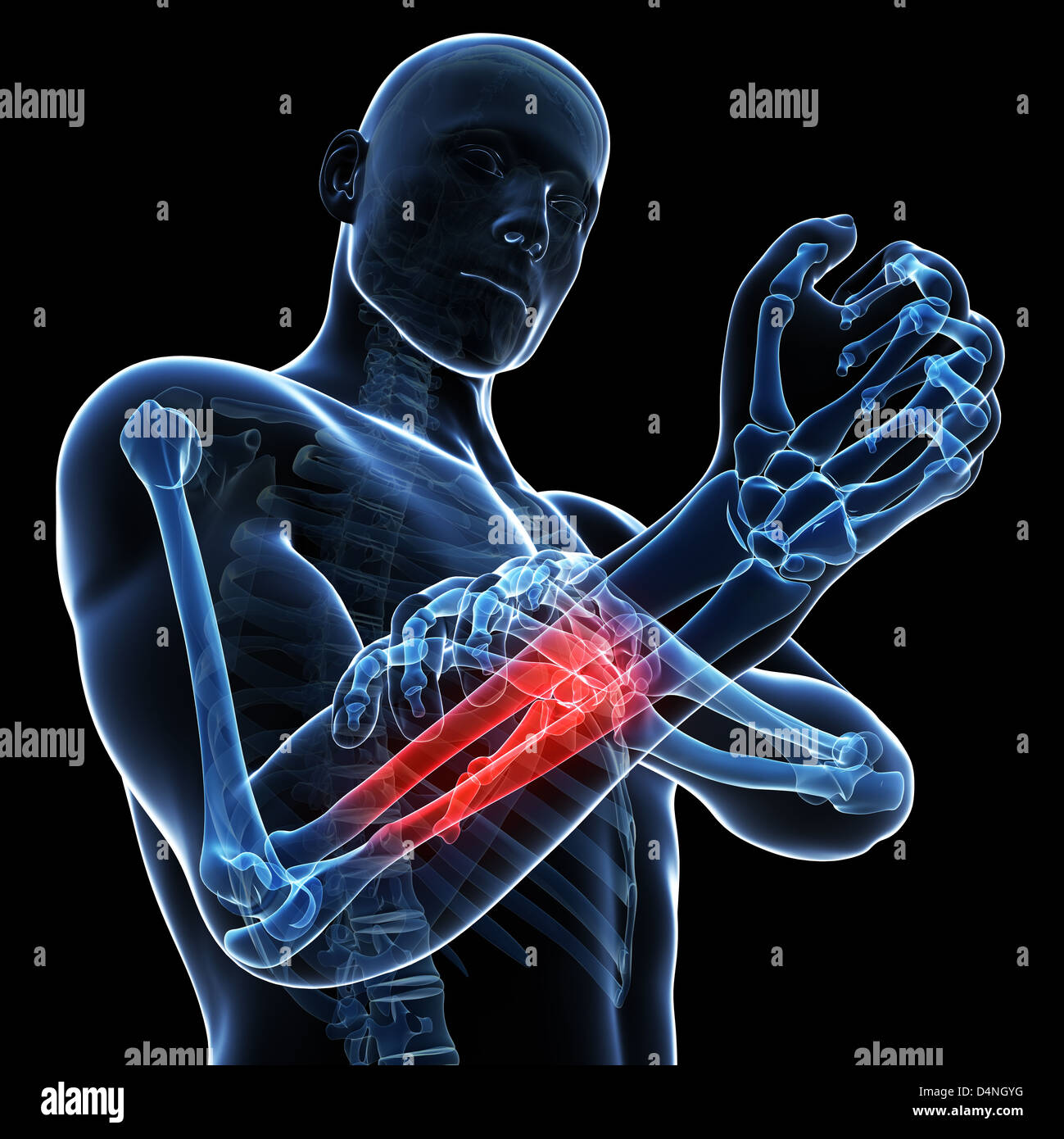 Anatomia del braccio immagini e fotografie stock ad alta risoluzione ...