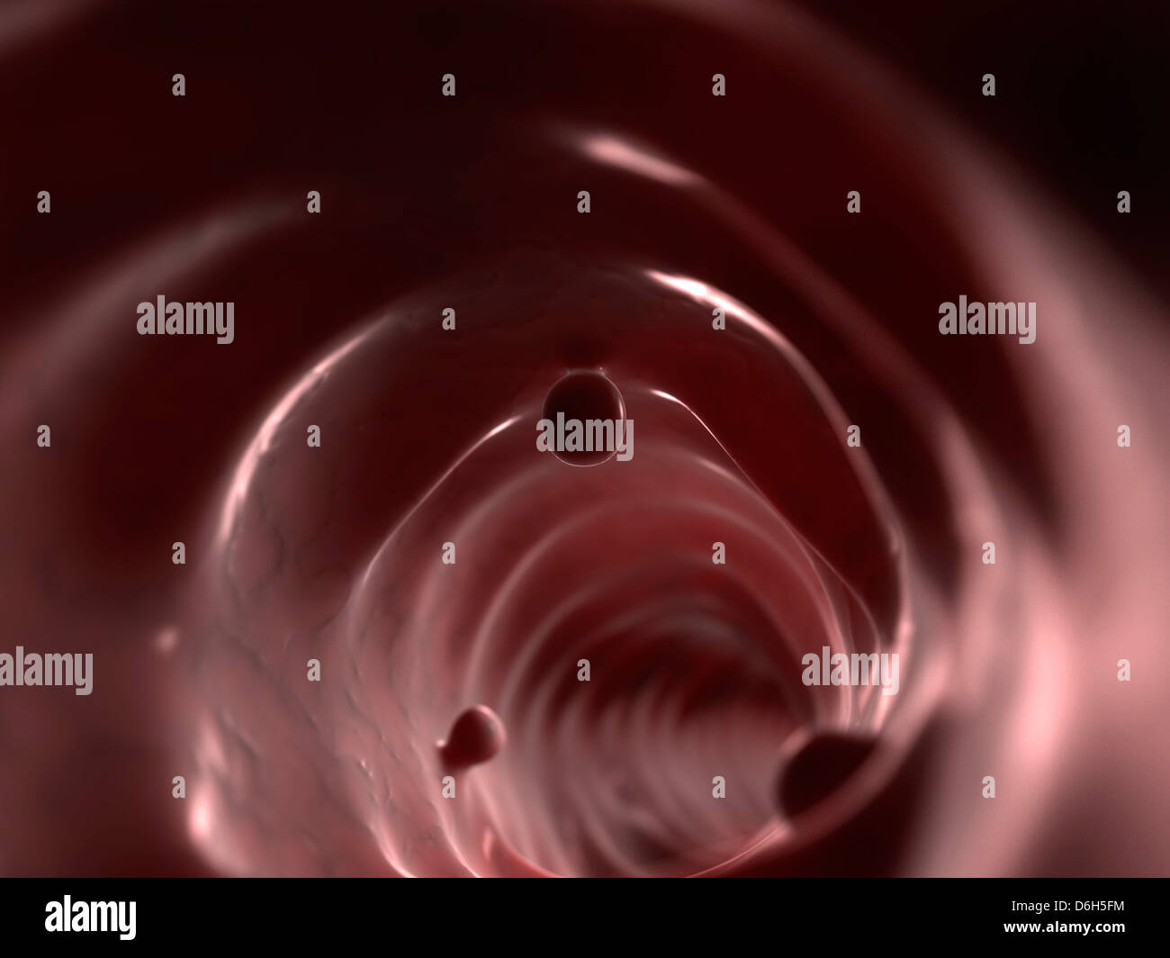 Colon polyps immagini e fotografie stock ad alta risoluzione - Alamy