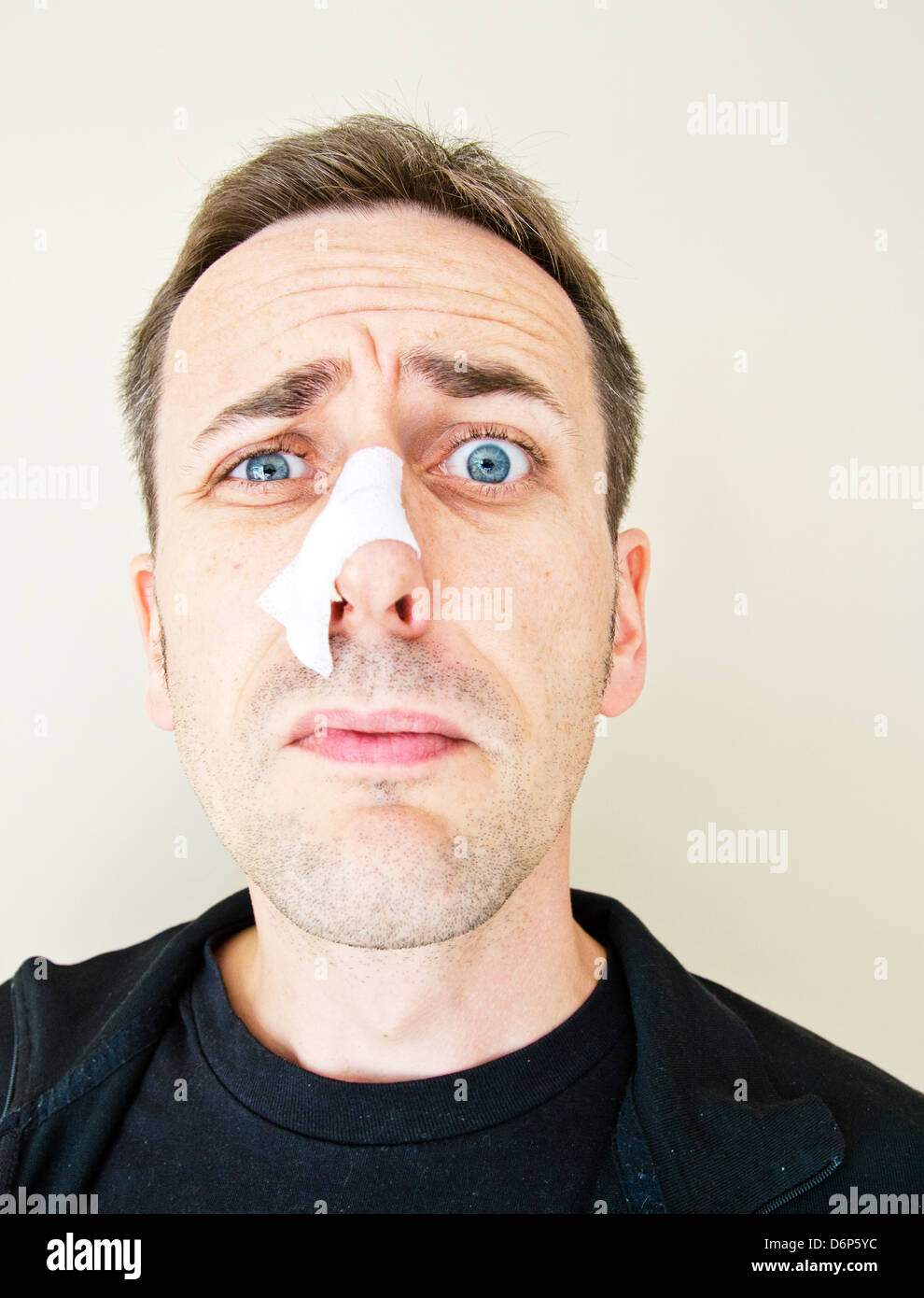 Nose plaster immagini e fotografie stock ad alta risoluzione - Alamy