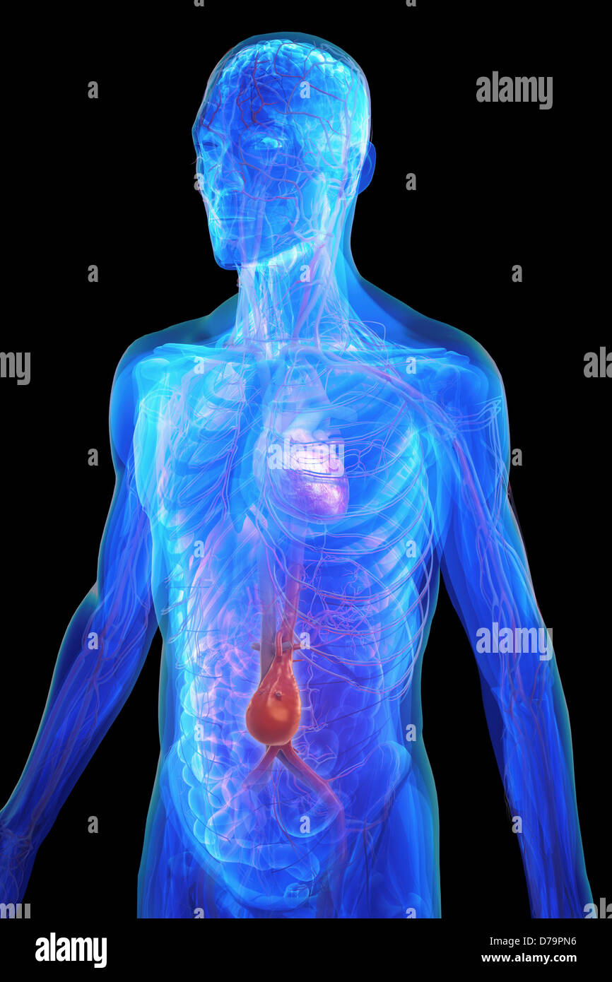 Aneurisma dell'aorta addominale immagini e fotografie stock ad alta risoluzione - Alamy
