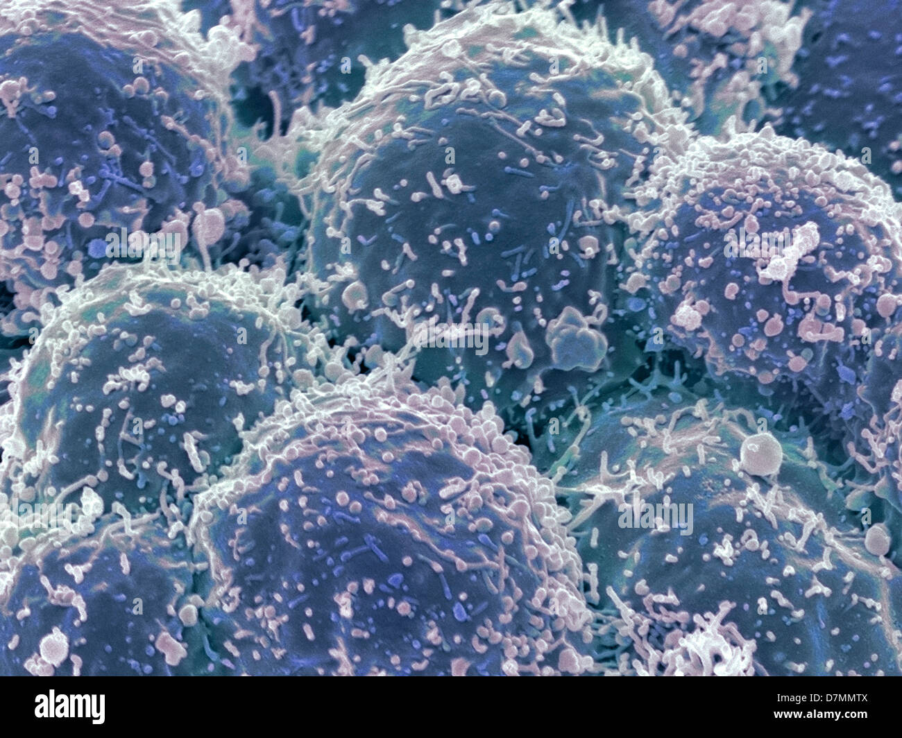 Cellule cancerose immagini e fotografie stock ad alta risoluzione - Alamy