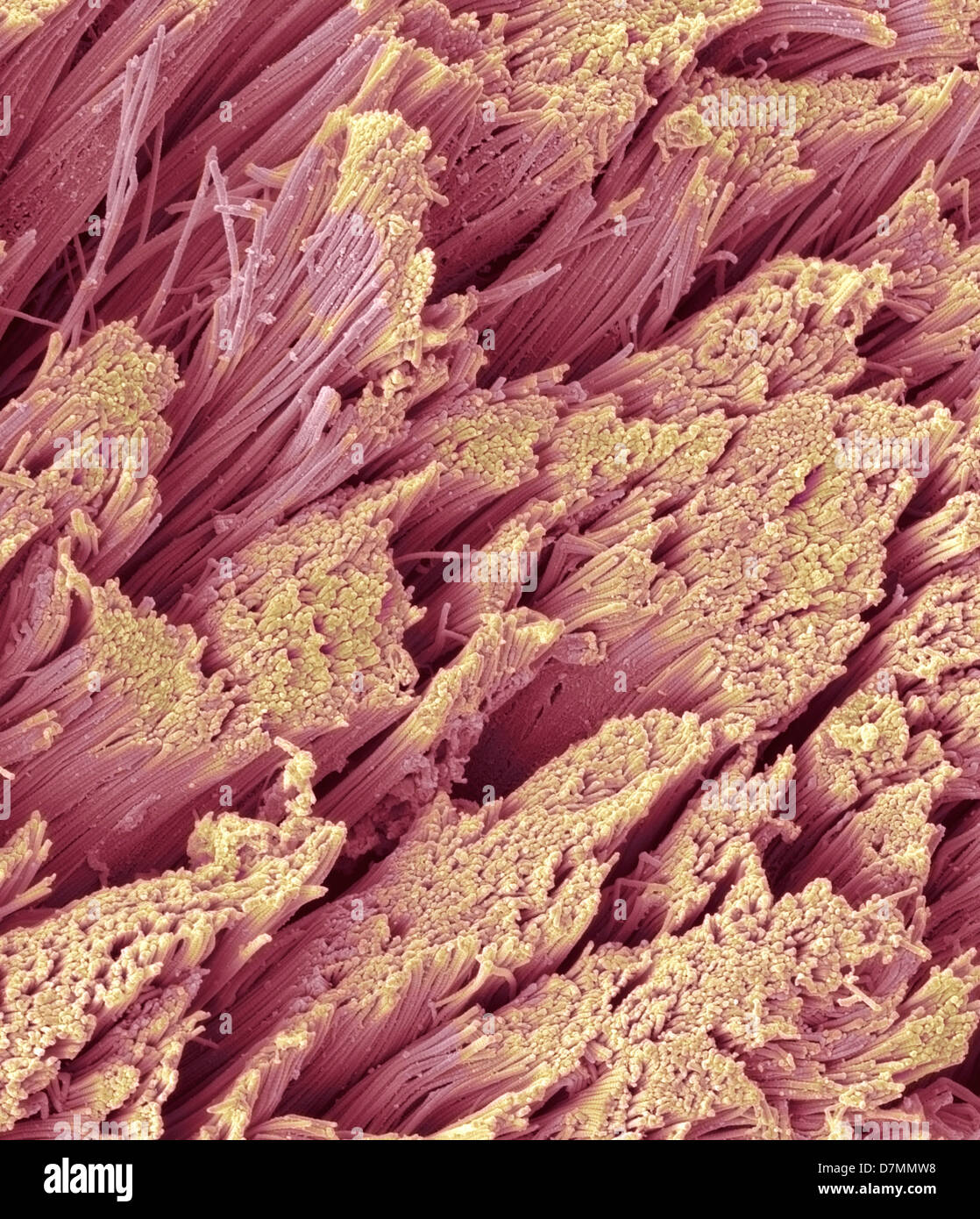Collagene microscopio elettronico immagini e fotografie stock ad alta risoluzione - Alamy