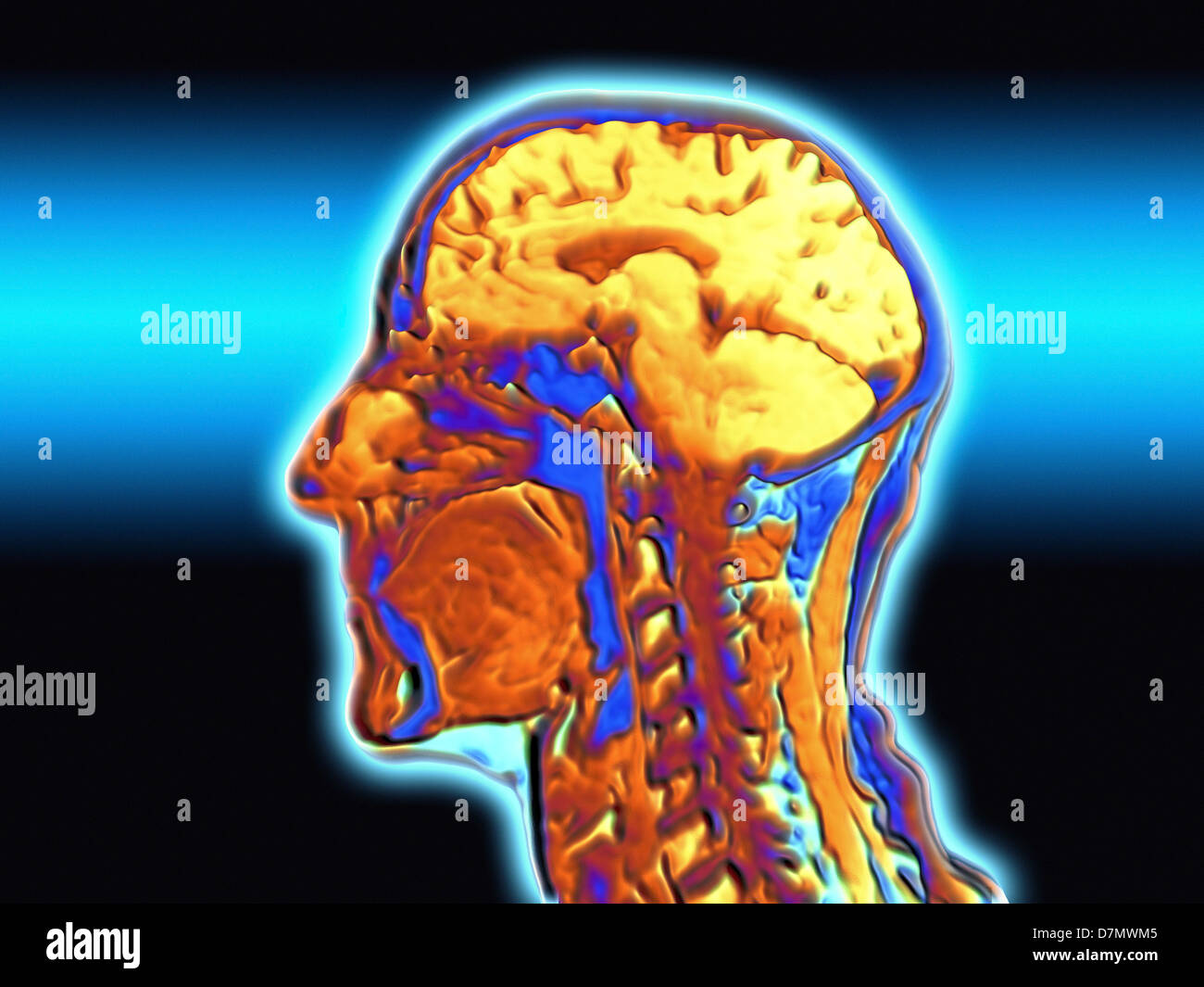 Risonanza magnetica immagini e fotografie stock ad alta risoluzione - Alamy