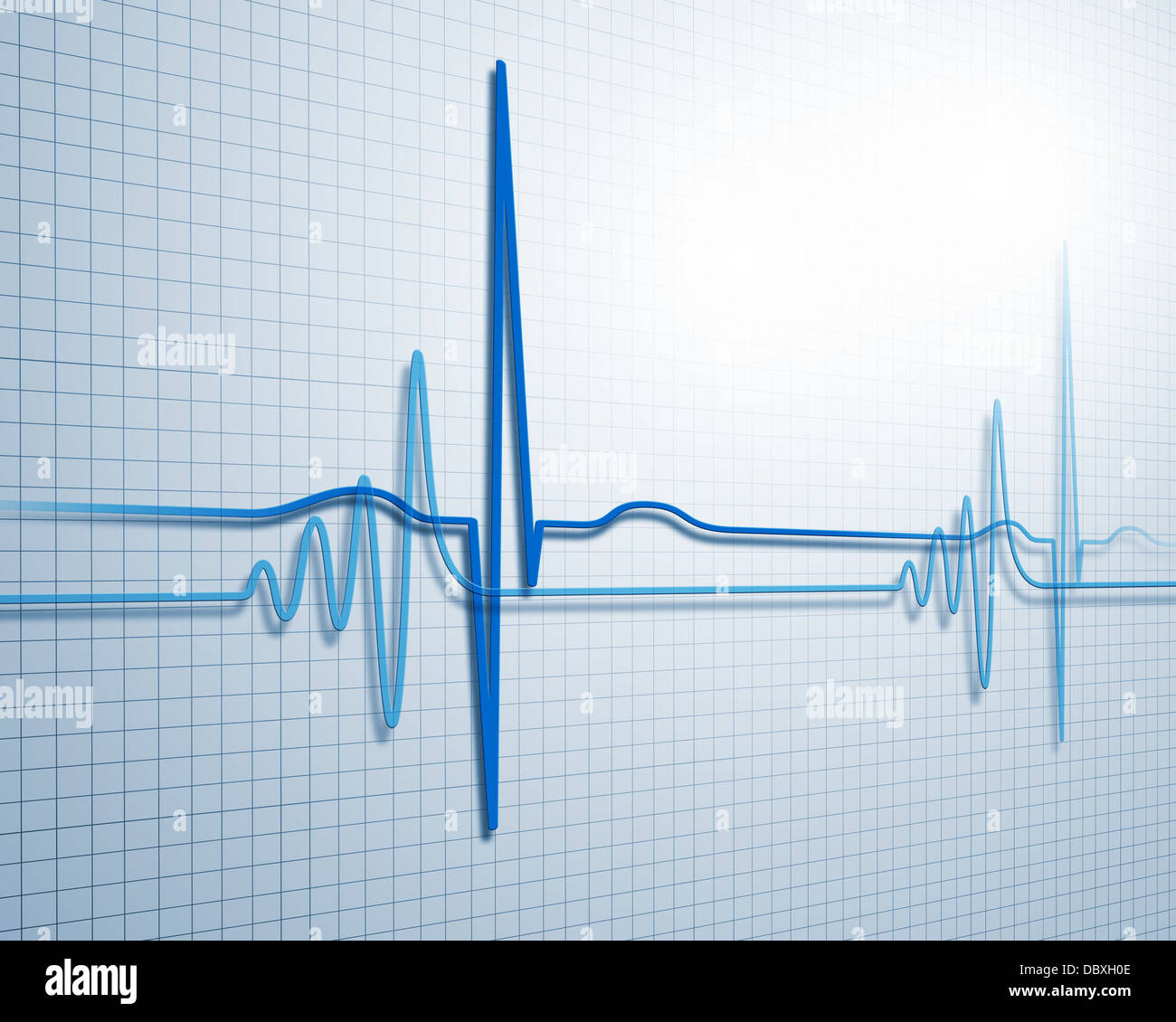 Monitor del battito cardiaco immagini e fotografie stock ad alta ...