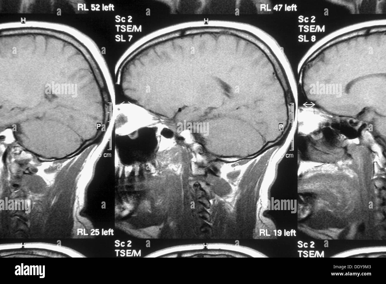 Sagittal plane immagini e fotografie stock ad alta risoluzione - Alamy