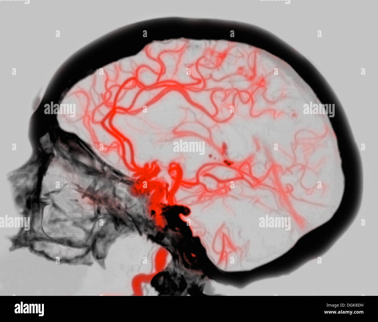 Circle of willis immagini e fotografie stock ad alta risoluzione - Alamy